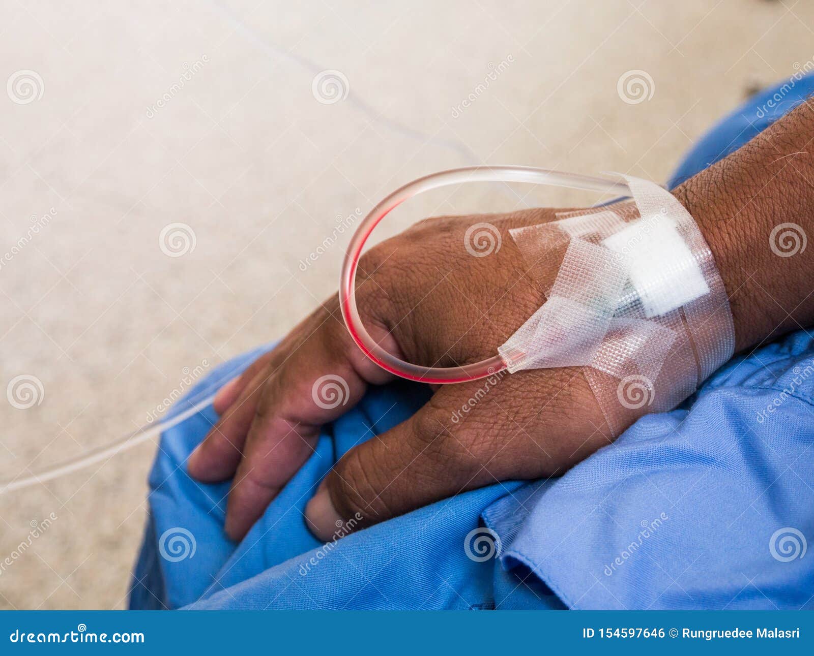 Patient Hand with IV Solution Stock Photo - Image of emergency, drop ...