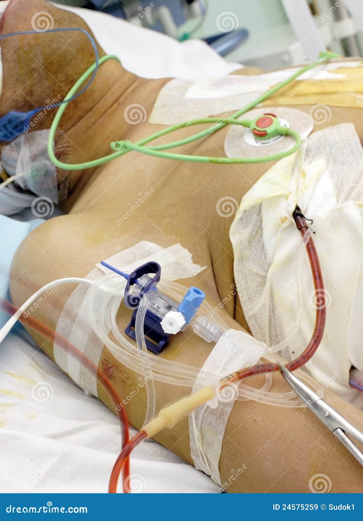 Patient in the ICU. Seriously Ill in Bed. Stock Image - Image of ...
