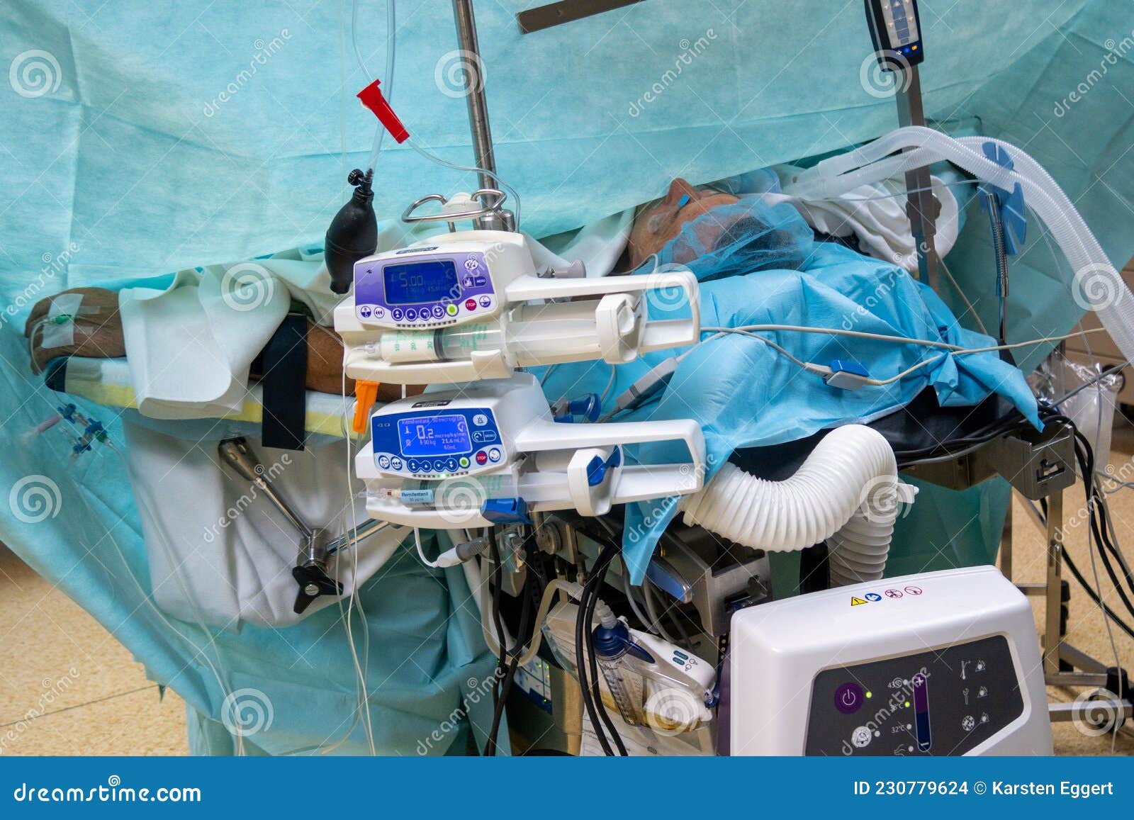 Patient Lies Ventilated Under General Anesthesia on an Operating Table ...