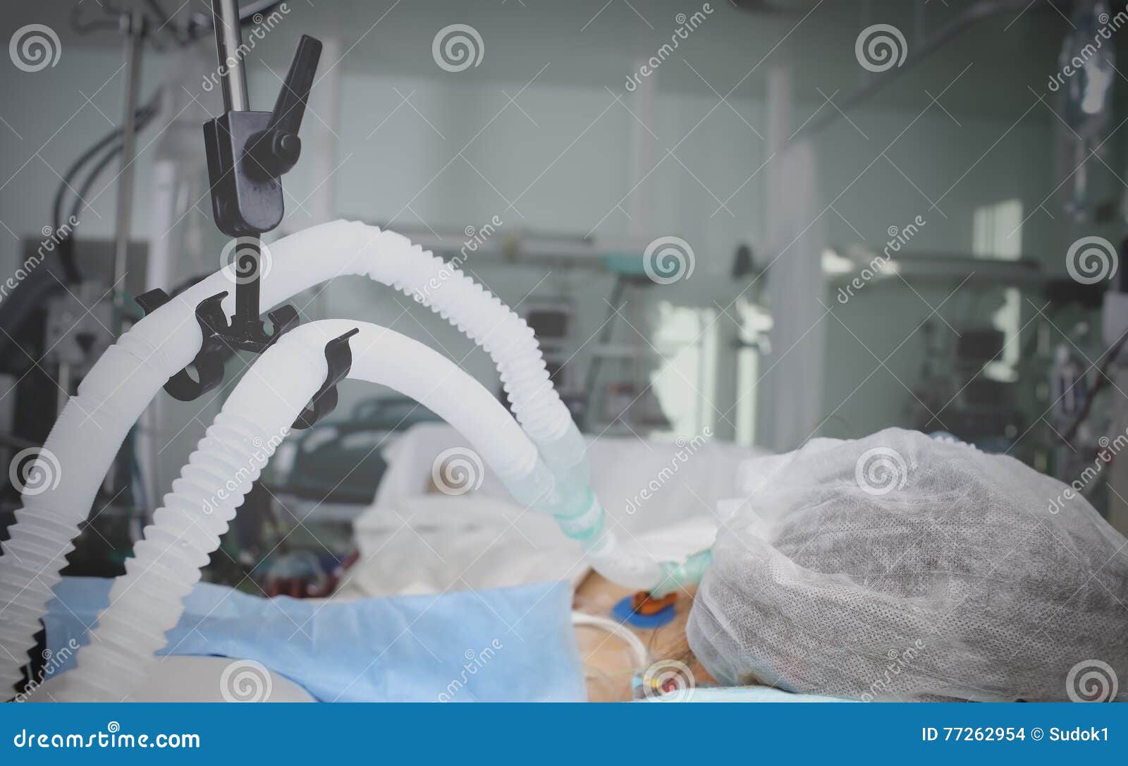 Patient on Mechanical Ventilation in a Coma Stock Photo - Image of ...