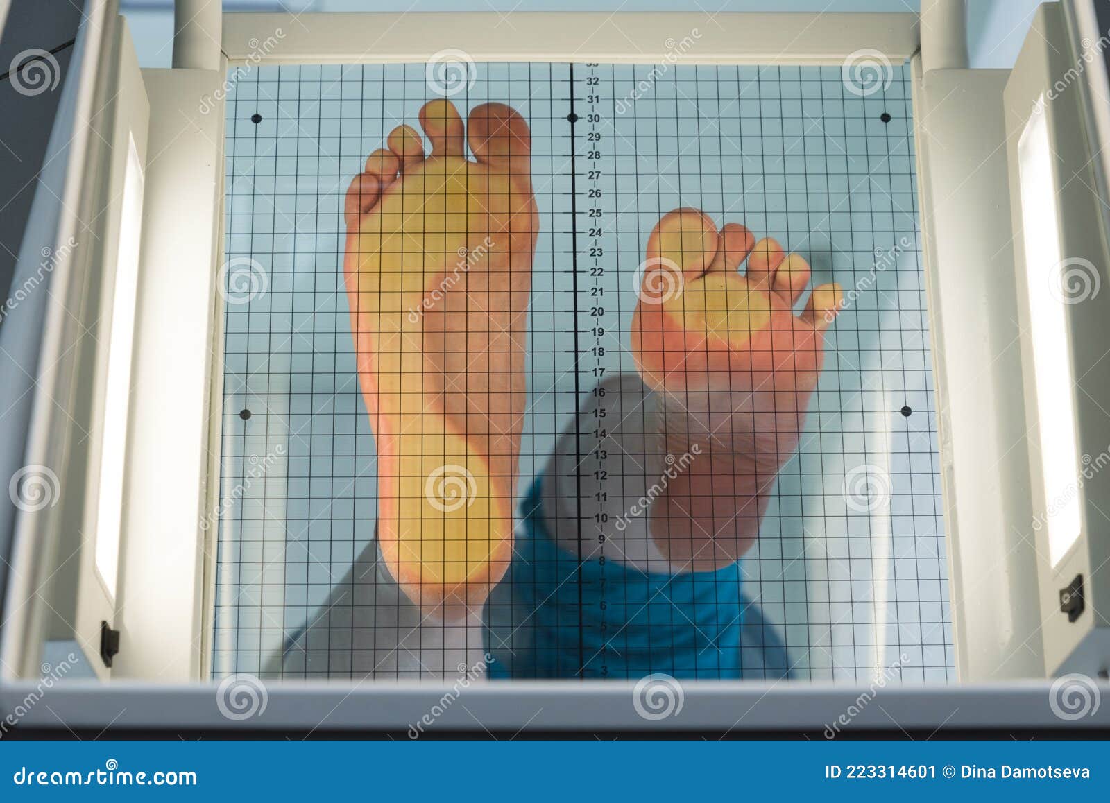 The Patient S Feet are Placed on a Special Apparatus for Determining ...