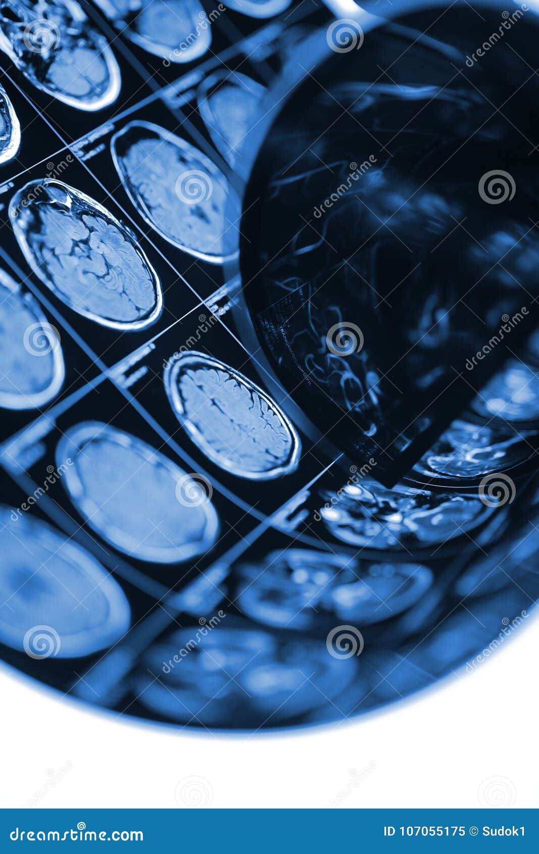 Head MRI Scan From Different Angles Stock Photography | CartoonDealer ...