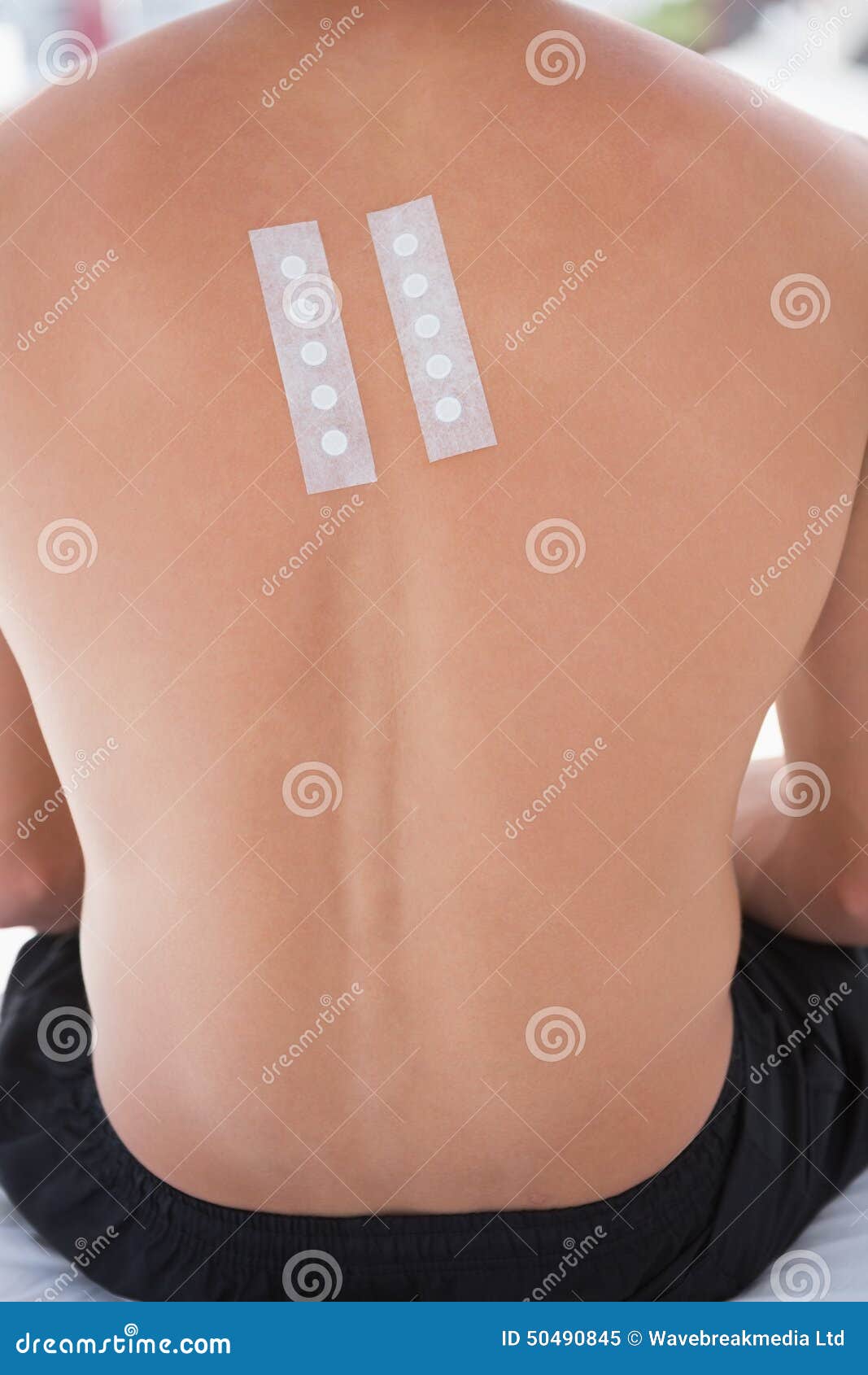 Patient with Skin Test in His Back Stock Image - Image of office ...
