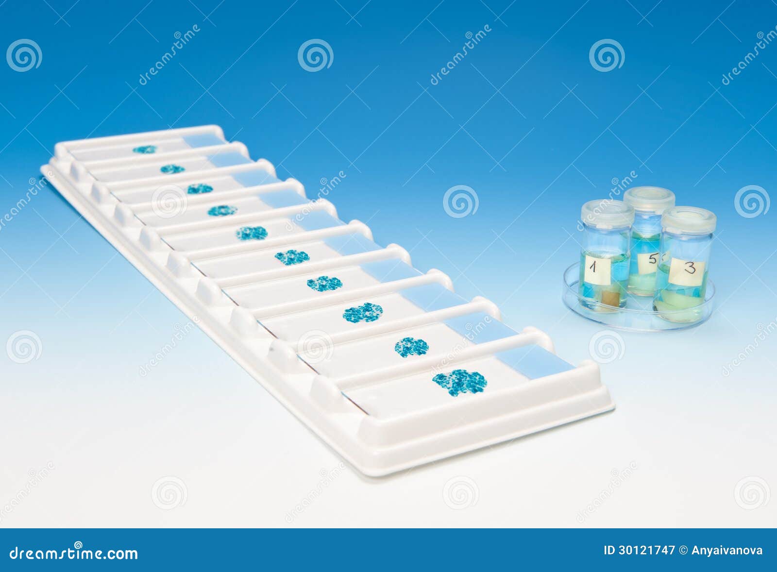 Patient biopsy samples stock image. Image of disease - 30121747