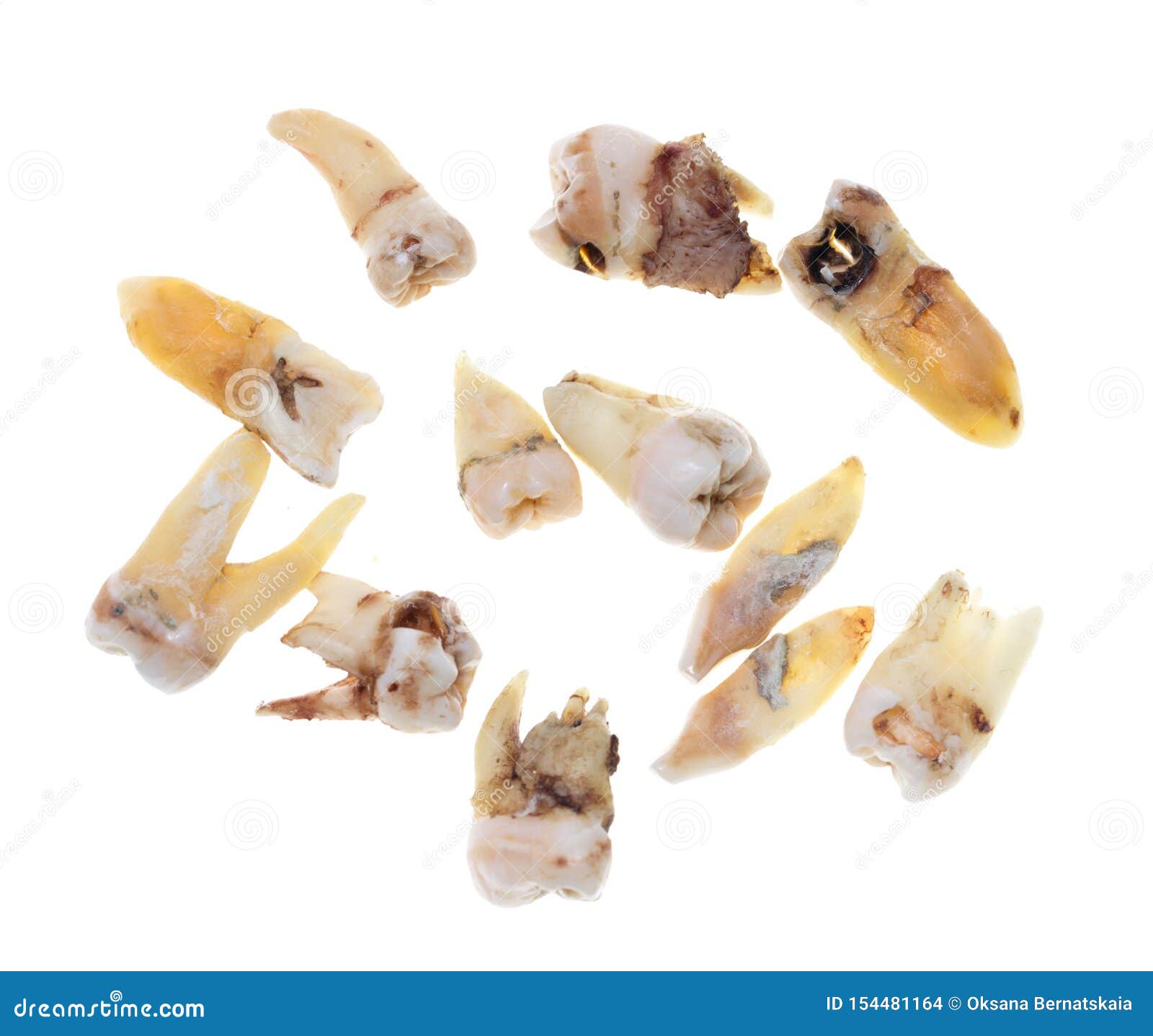 Patients Extracted Teeth on a White Background Stock Photo - Image of ...