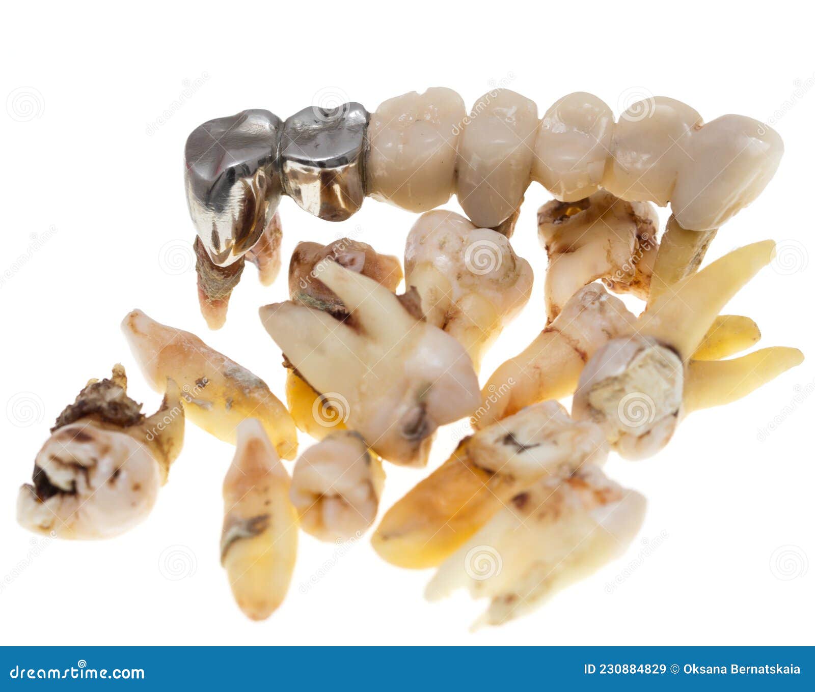 Extracted Teeth Royalty-Free Stock Photo | CartoonDealer.com #81929991