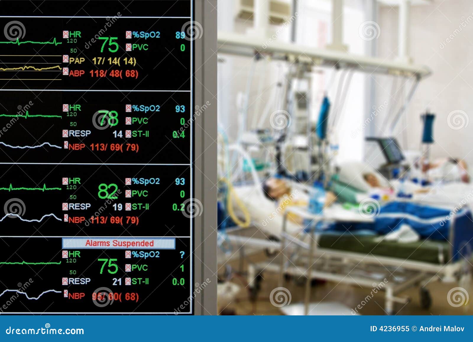 Patients monitoring in ICU stock image. Image of clinic - 4236955