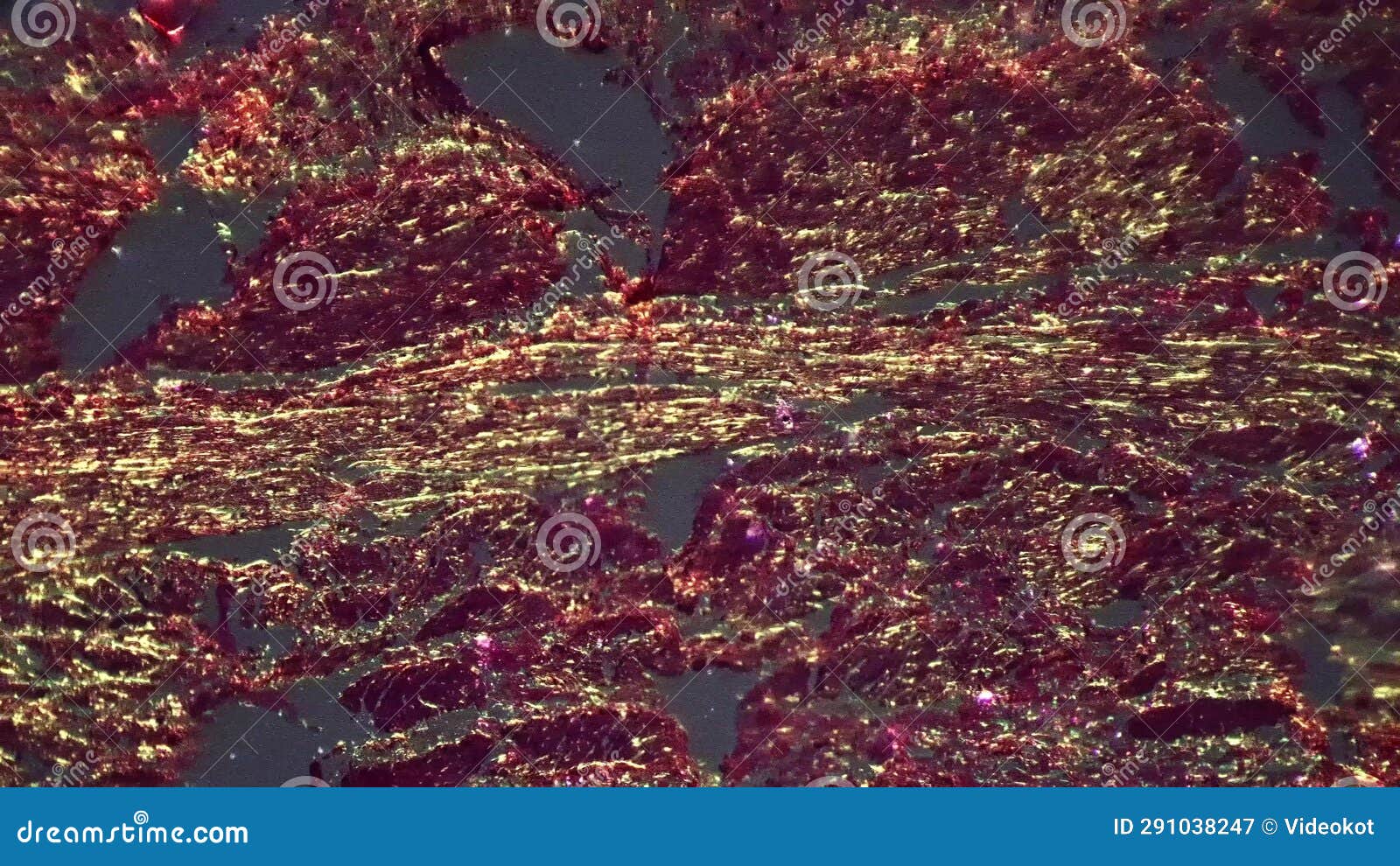 Pattern of Expand Human Bladder in Section Magnified with Microscope ...