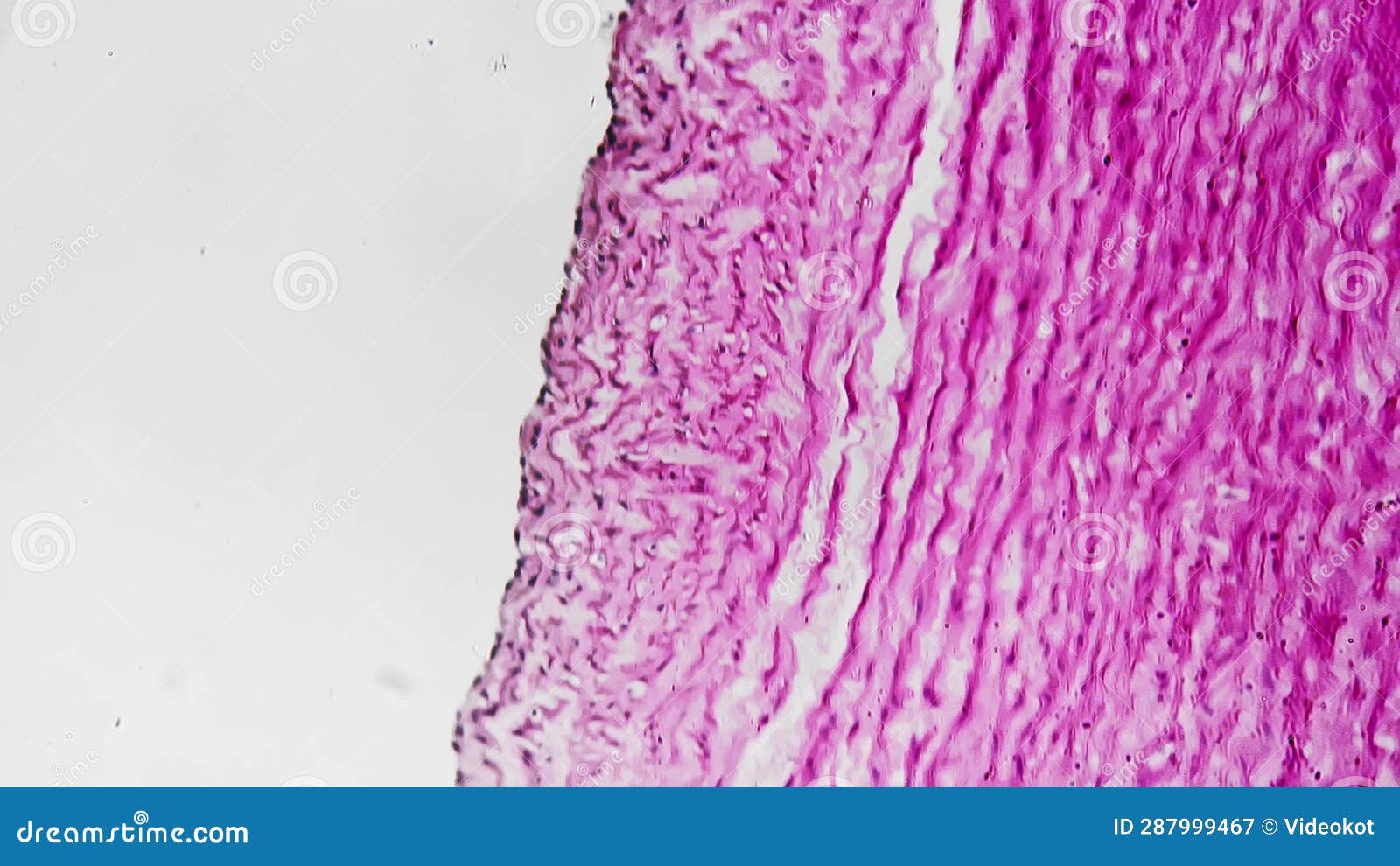 Pattern of Human Large Artery Taken for Experiment and Magnified Under ...