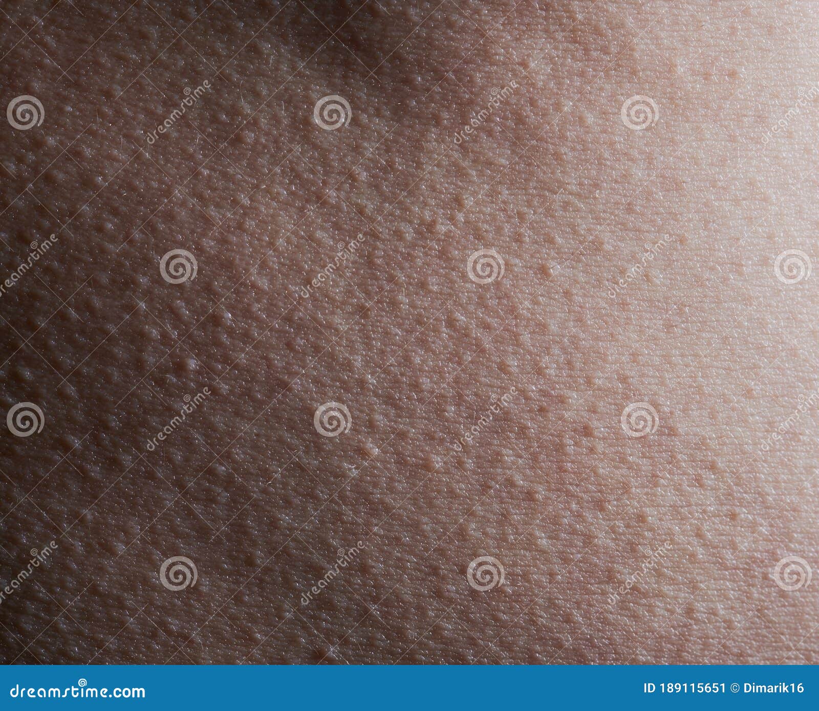 Pattern of Human Skin with Bumps Stock Image - Image of ectoderm, close ...