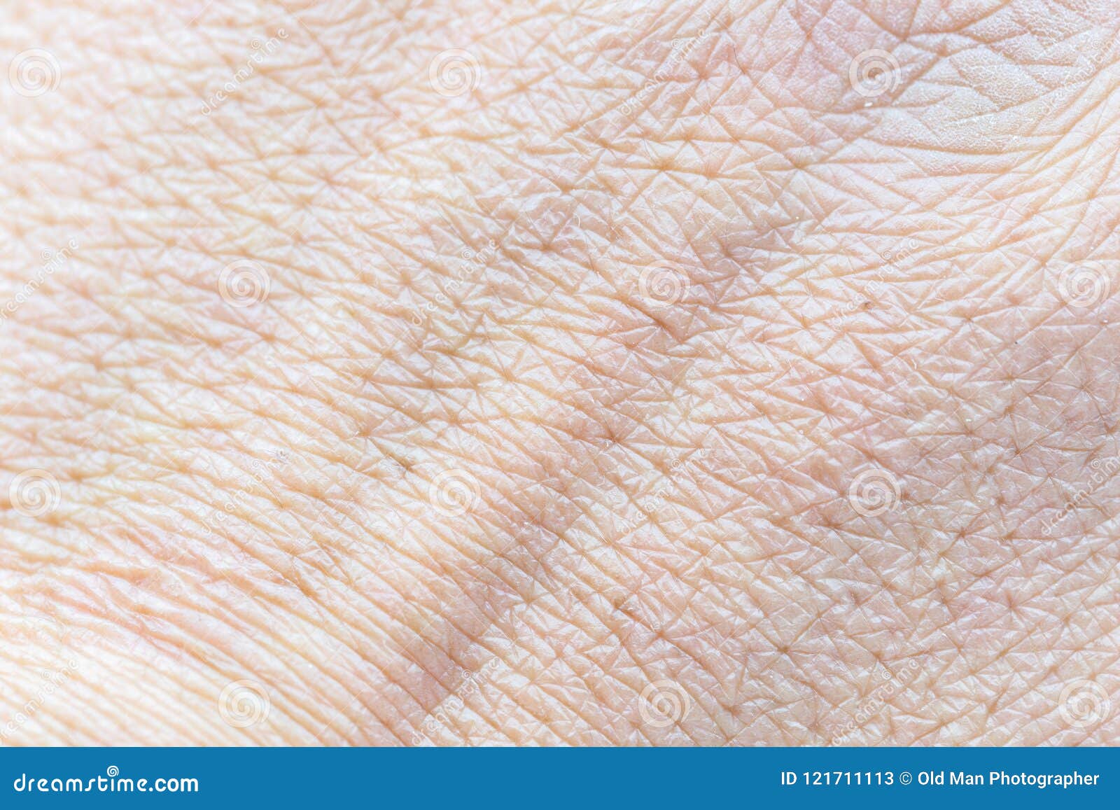 White Human Skin Texture