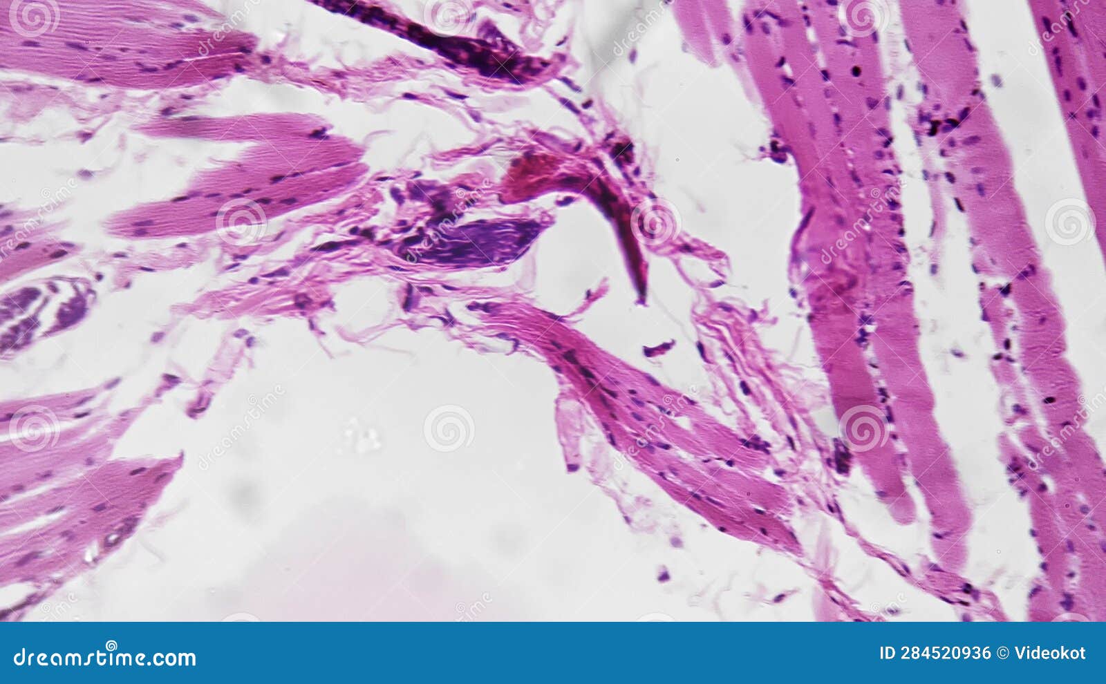 Pattern of Human Tongue in Section Showing Filiform Papillae Under ...