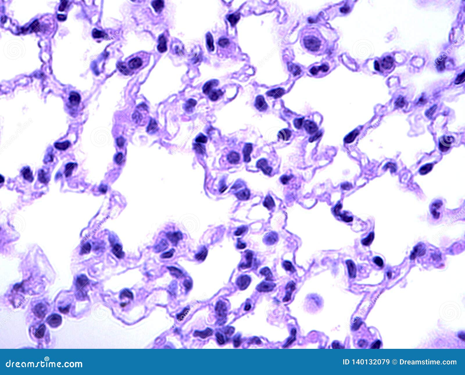 Pattern Lung cells stock image. Image of pattern, citoplasm - 140132079