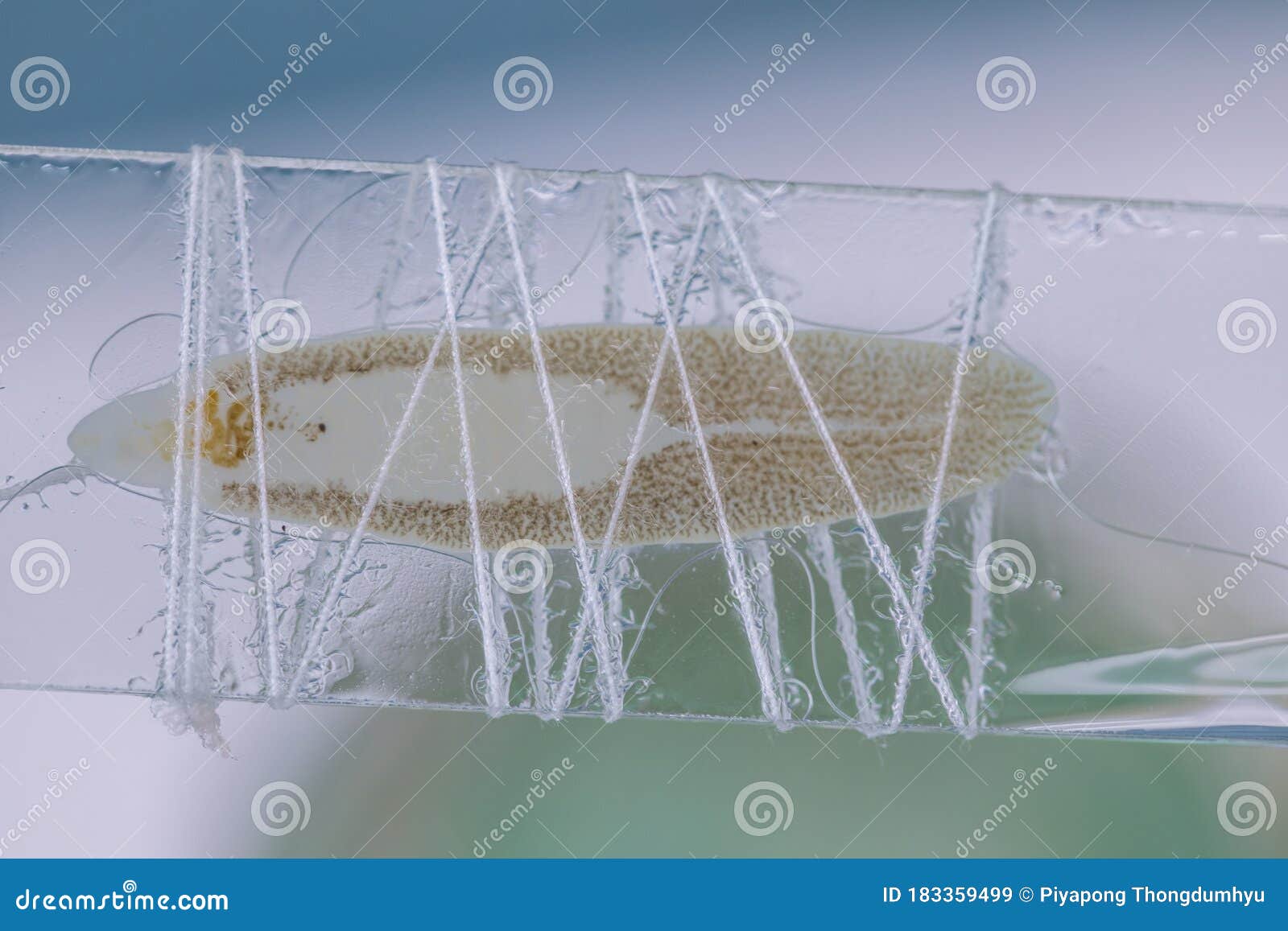 Backgrounds Of Parasitic, Study Of Parasitic And Anatomical Pathology ...