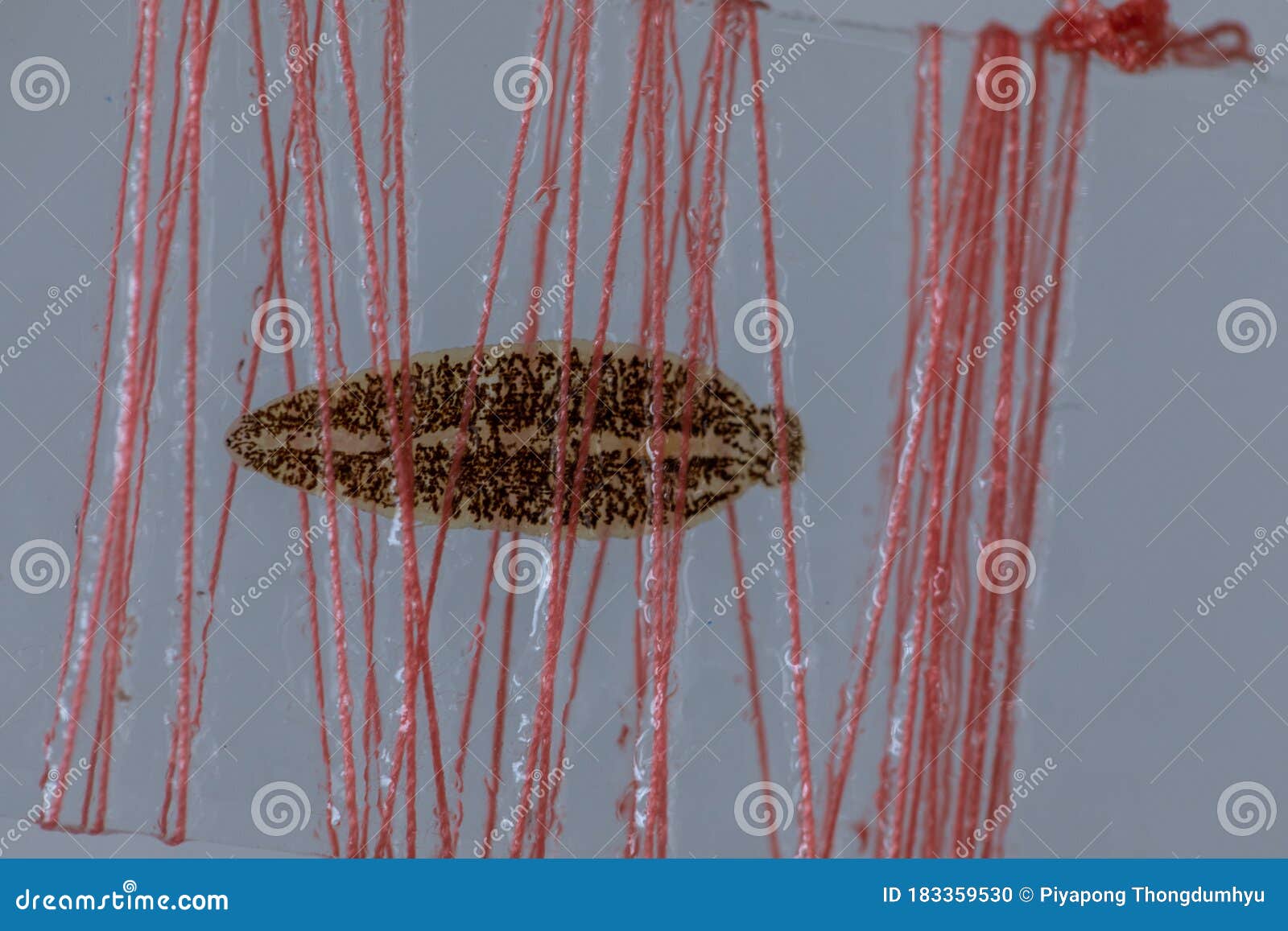 Backgrounds Of Parasitic, Study Of Parasitic And Anatomical Pathology ...