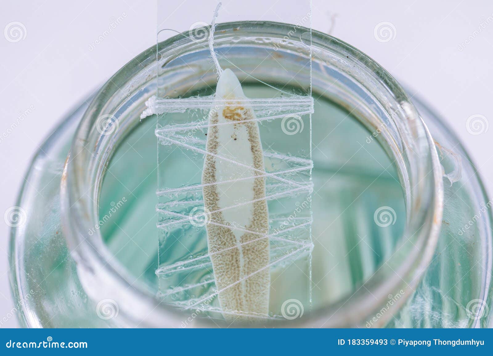 Backgrounds Of Parasitic, Study Of Parasitic And Anatomical Pathology ...