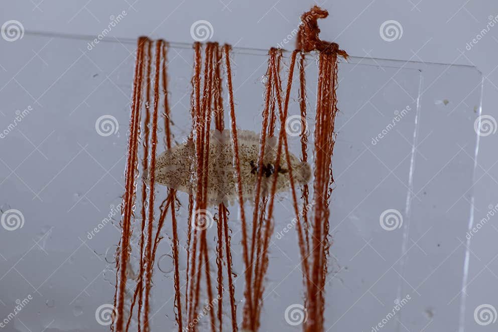 Backgrounds of Parasitic, Study of Parasitic and Anatomical Pathology ...