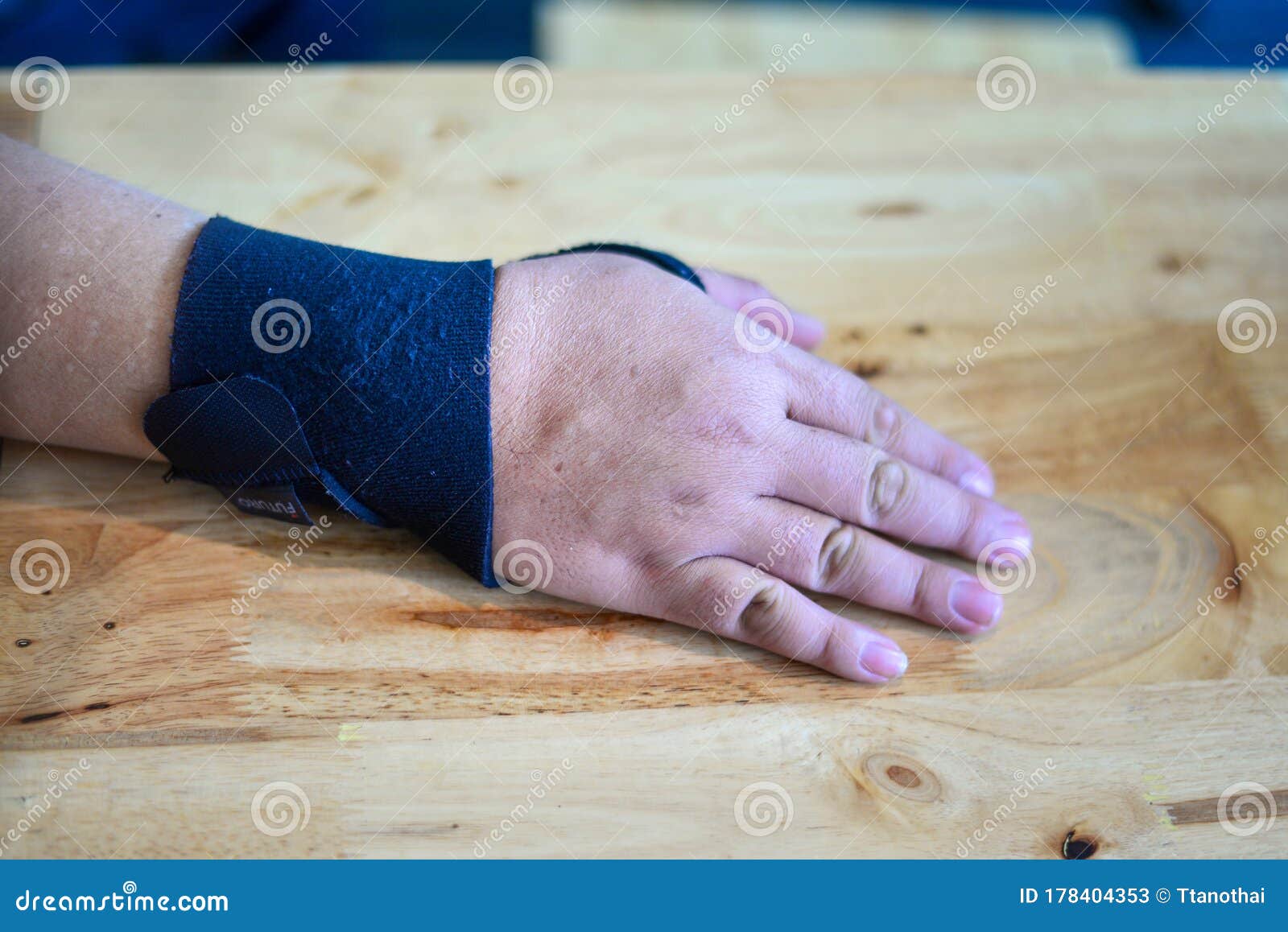 Paziente Ferito, Polso Rotto E Braccio Con Bendaggio Nero Immagine ...