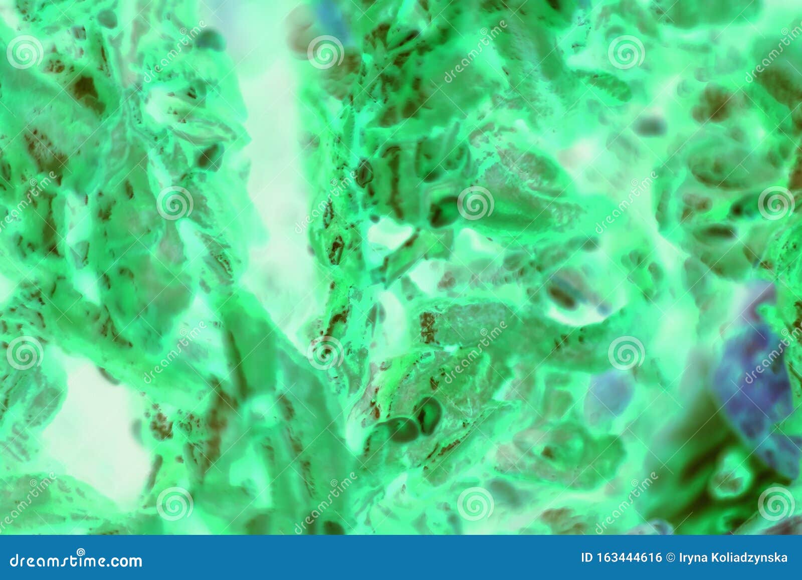 PC-3 Human Prostate Cancer Cells Stained with Blue Coomassie, Under a ...