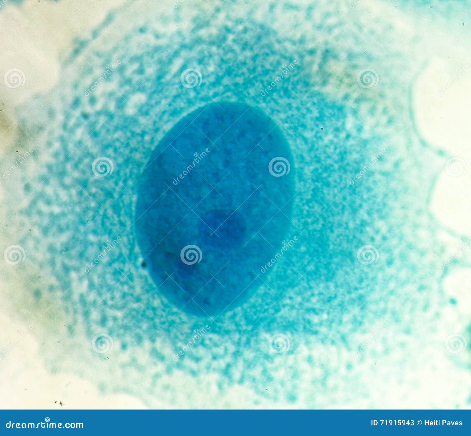 PC-3 Human Prostate Cancer Cells Stock Image - Image of coomassie ...