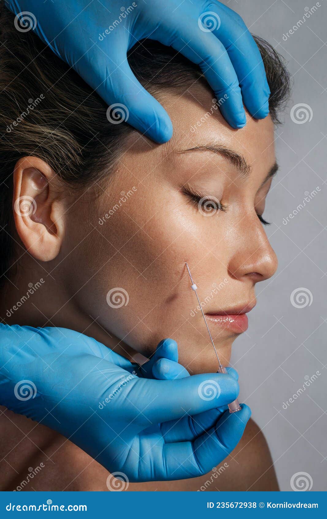 Face lifting surgery stock photo. Image of antiaging - 235672938