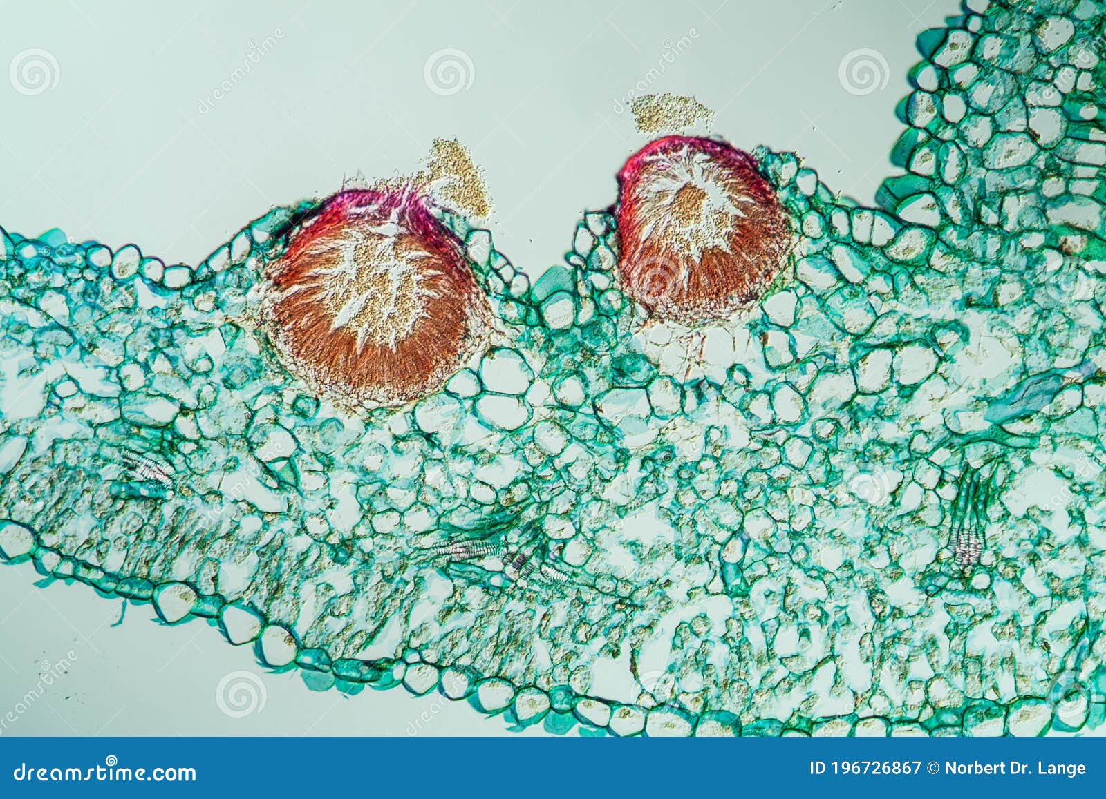 Pea Rust Parasitic Mushroom Stock Image - Image of 100x, plants: 196726867
