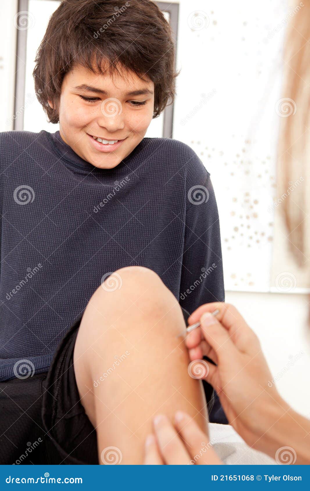 Pediatric Acupuncture stock photo. Image of health, child - 21651068