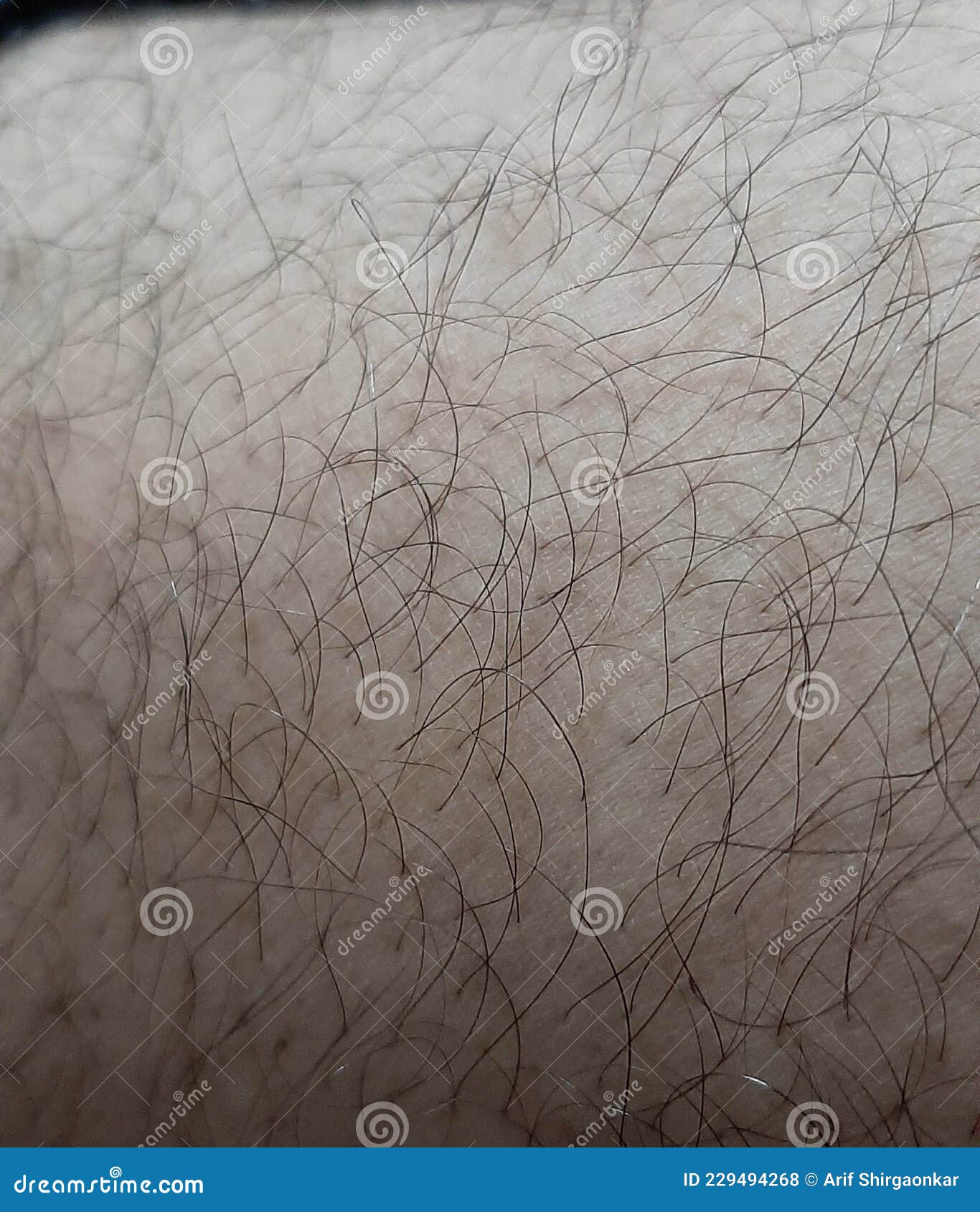 Pelo do corpo humano foto de stock. Imagem de cabelo - 229494268