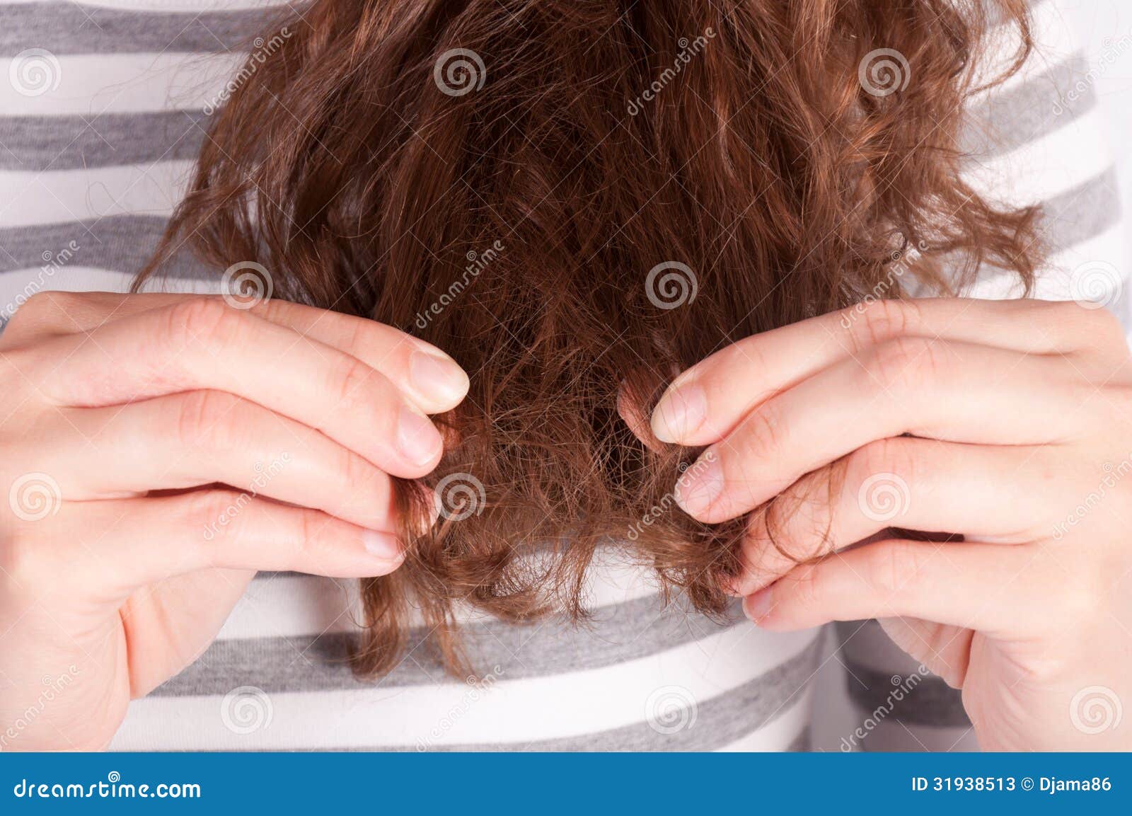 Pelo quebrado imagen de archivo. Imagen de calvicie, maduro - 31938513