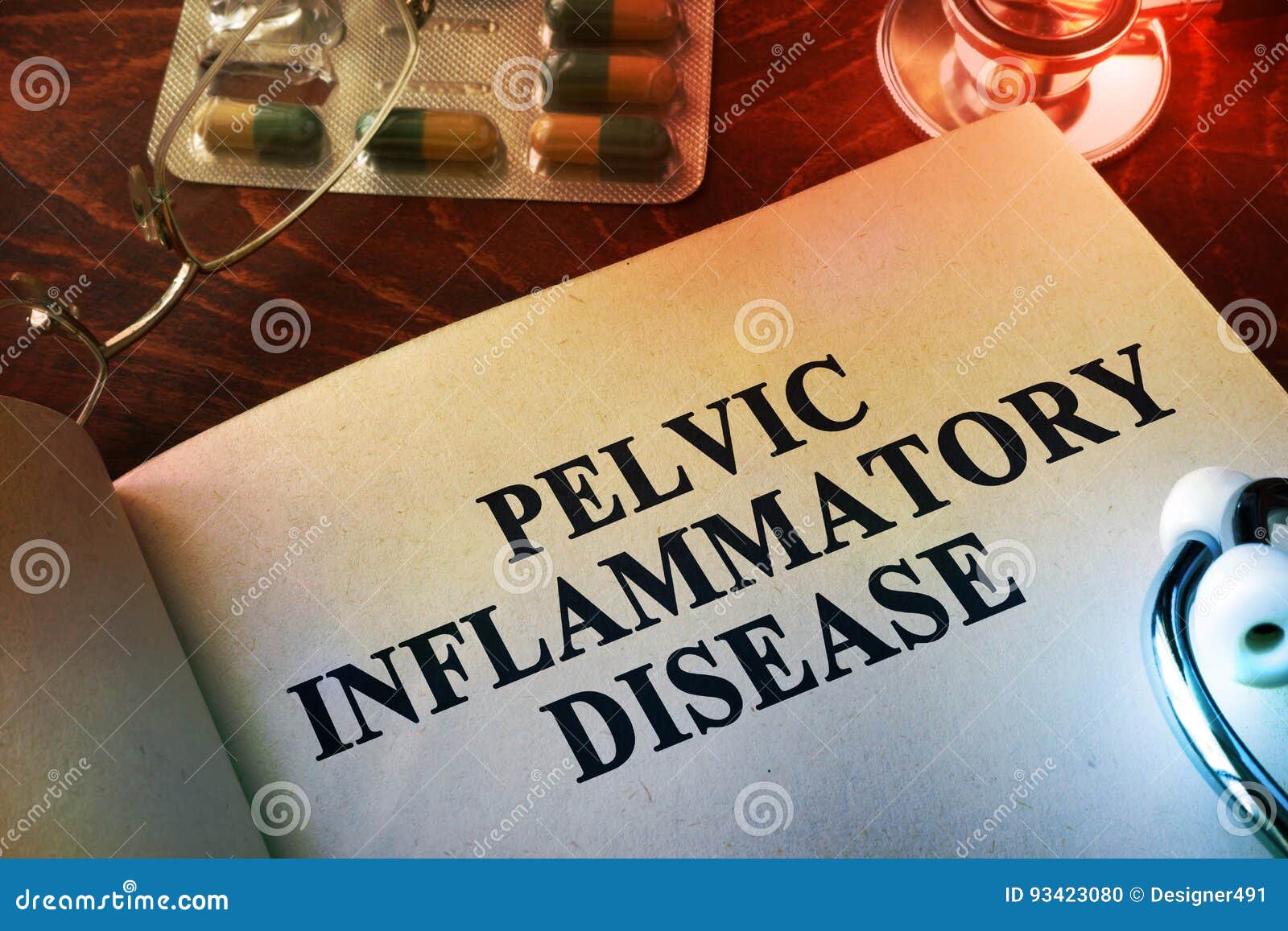 Pelvic Inflammatory Disease PID. Stock Photo - Image of treatment, exam ...