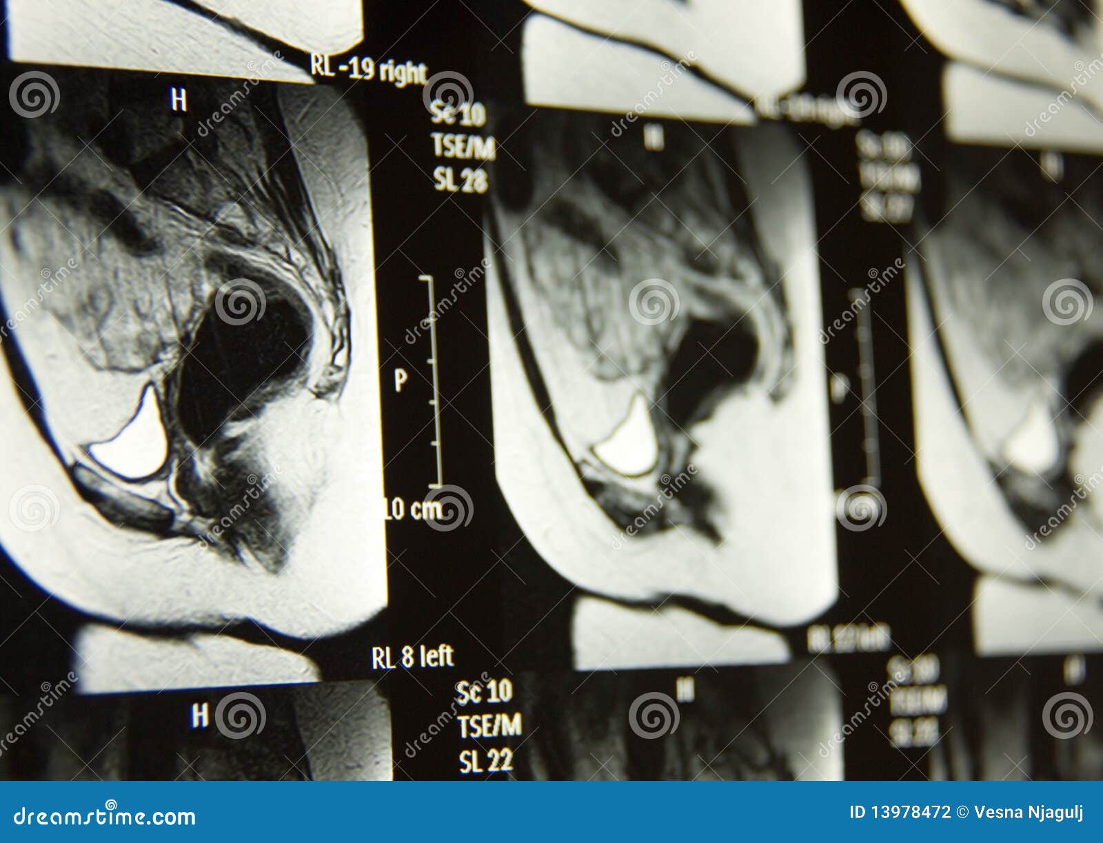 Pelvic MRI stock photo. Image of xray, urogenital, injury - 13978472