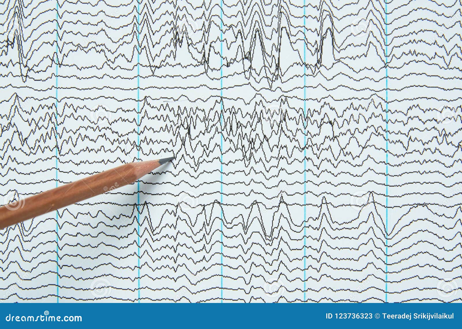 Imaging of Electroencephalography Recording of Human Stock Image ...