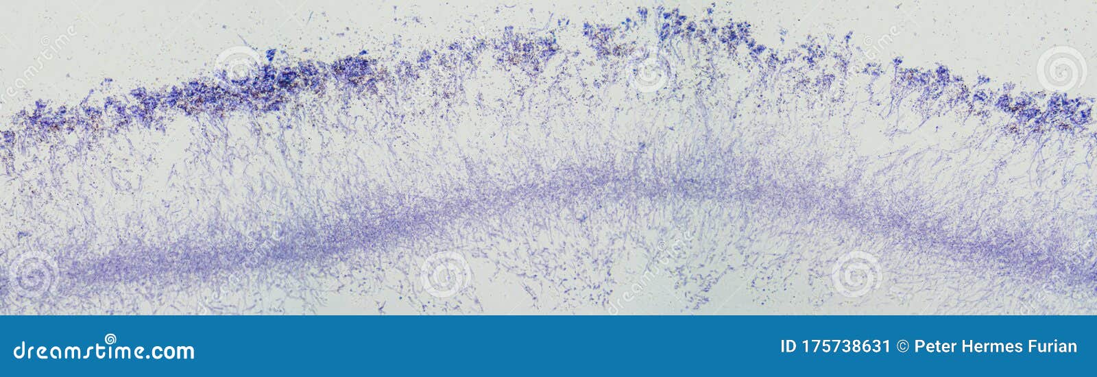 Penicillium, Ascomycetous Fungi, Under the Microscope Stock Image ...