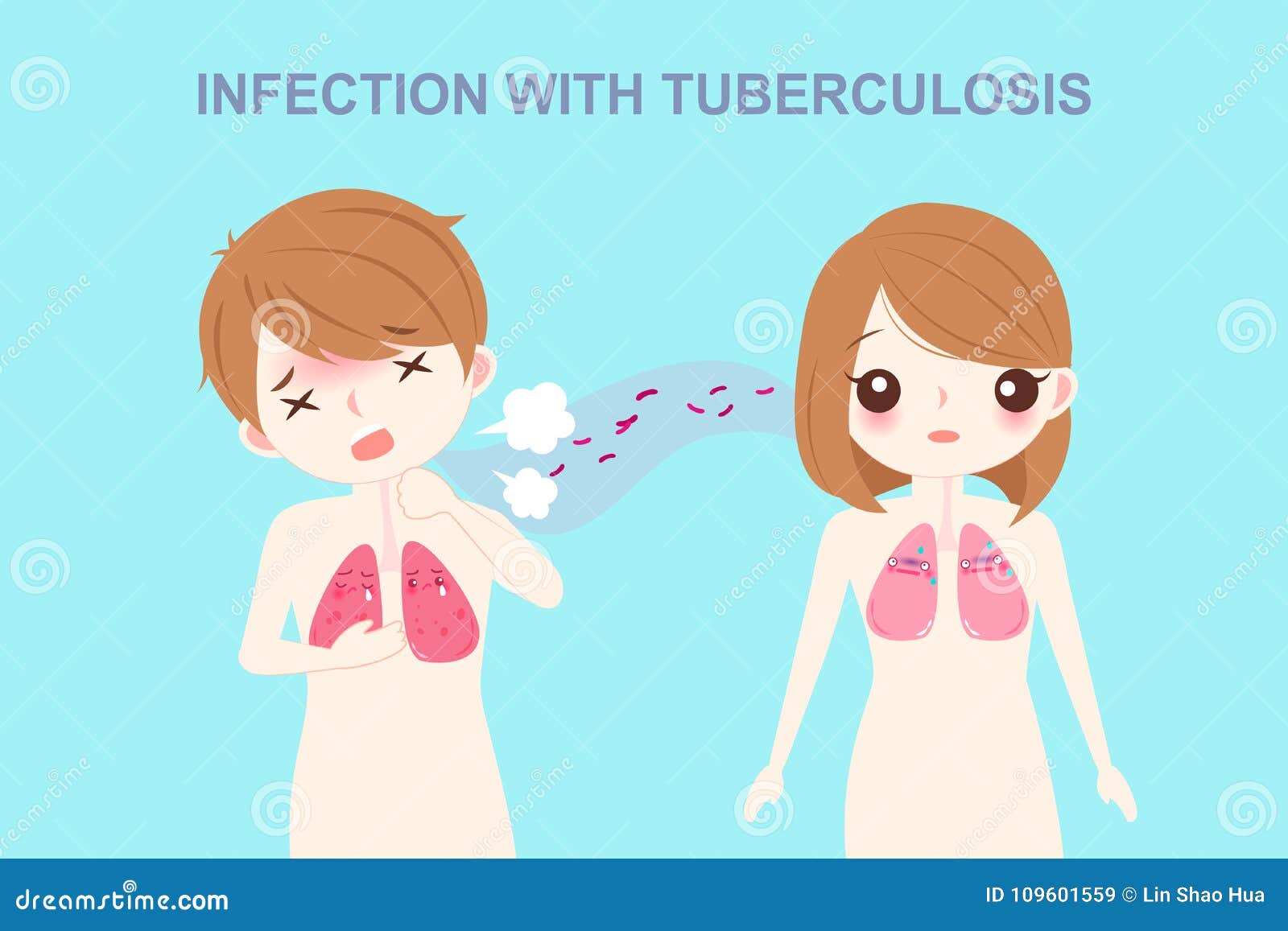 People with tuberculosis stock vector. Illustration of people - 109601559