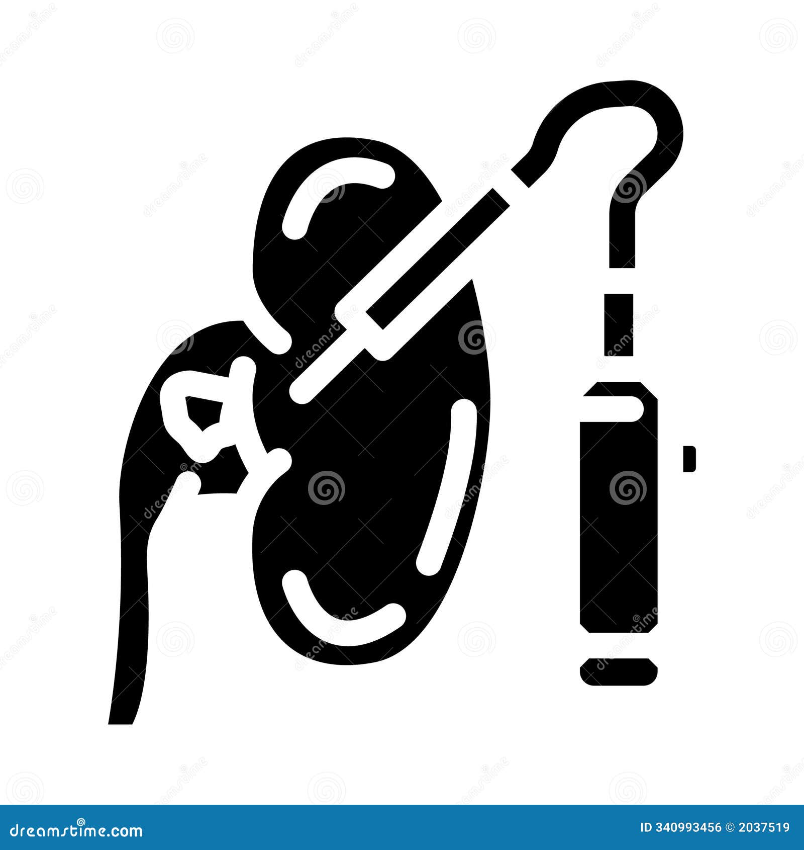 Percutaneous Nephrolithotomy. Kidney Stone Removing Surgery ...