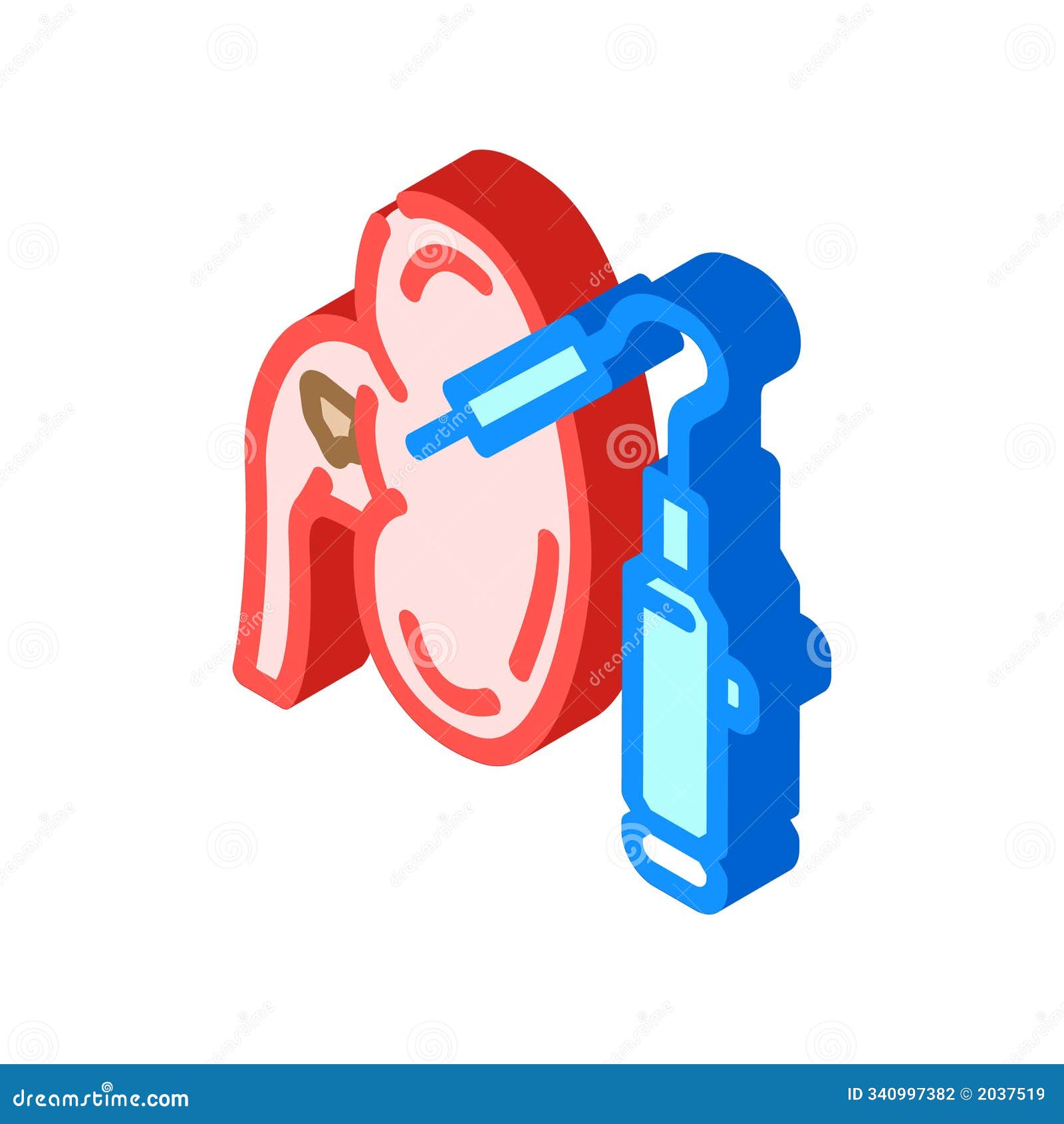 Percutaneous Nephrolithotomy Surgery Isometric Icon Vector Illustration ...