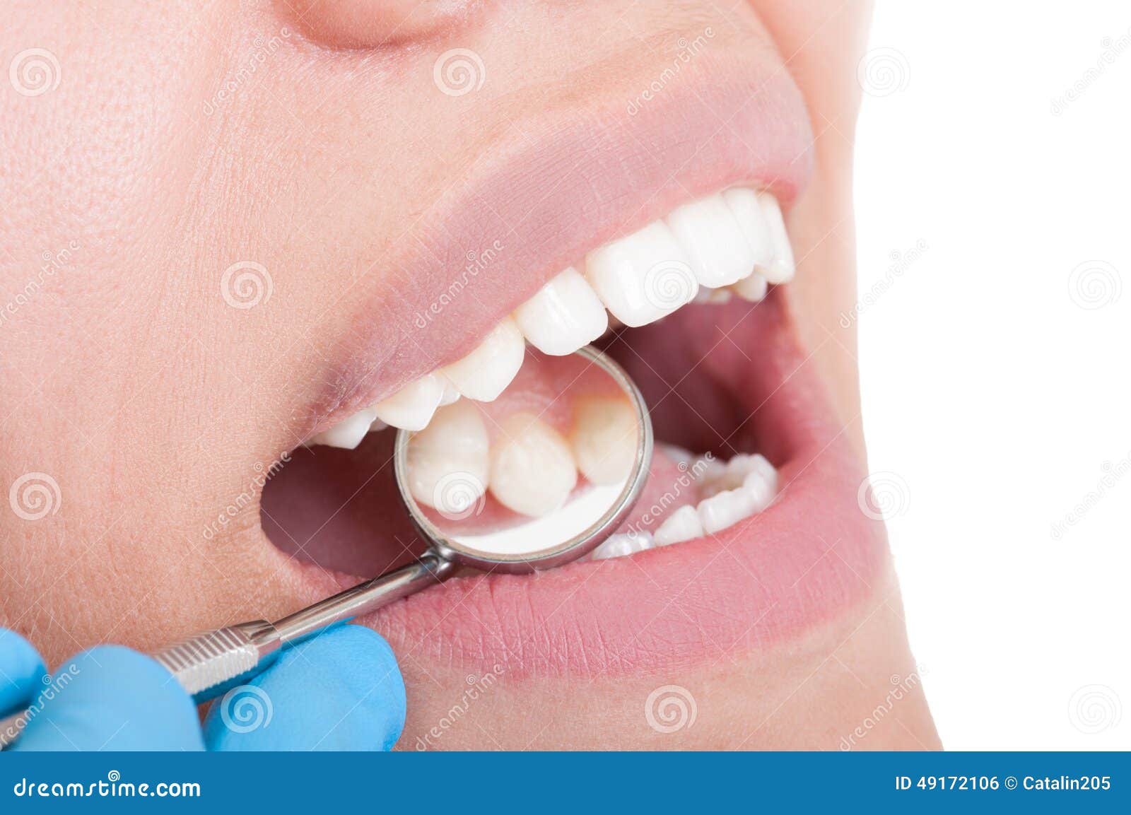 Perfect teeth stock photo. Image of oral, caries, macro - 49172106