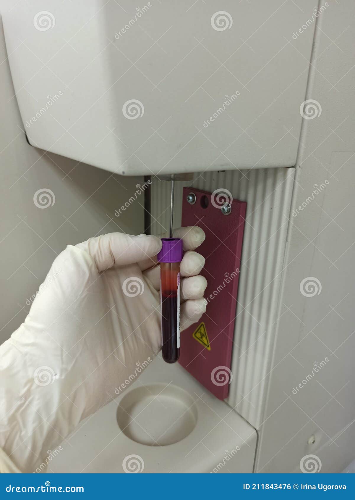 Perform a General Blood Test on a Analyzer. Stock Photo - Image of ...