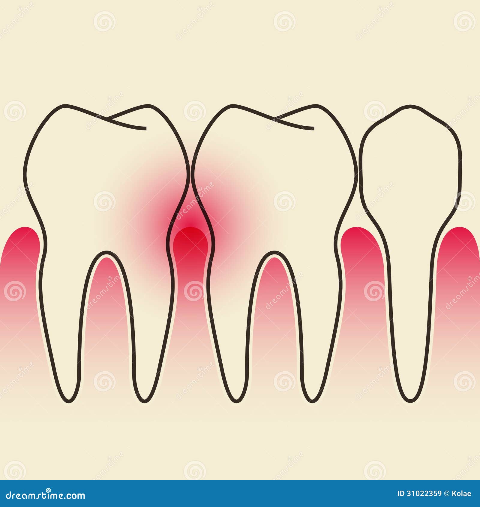 Periodontal Disease Transparent Icon. Periodontal Disease Symbol Vector ...