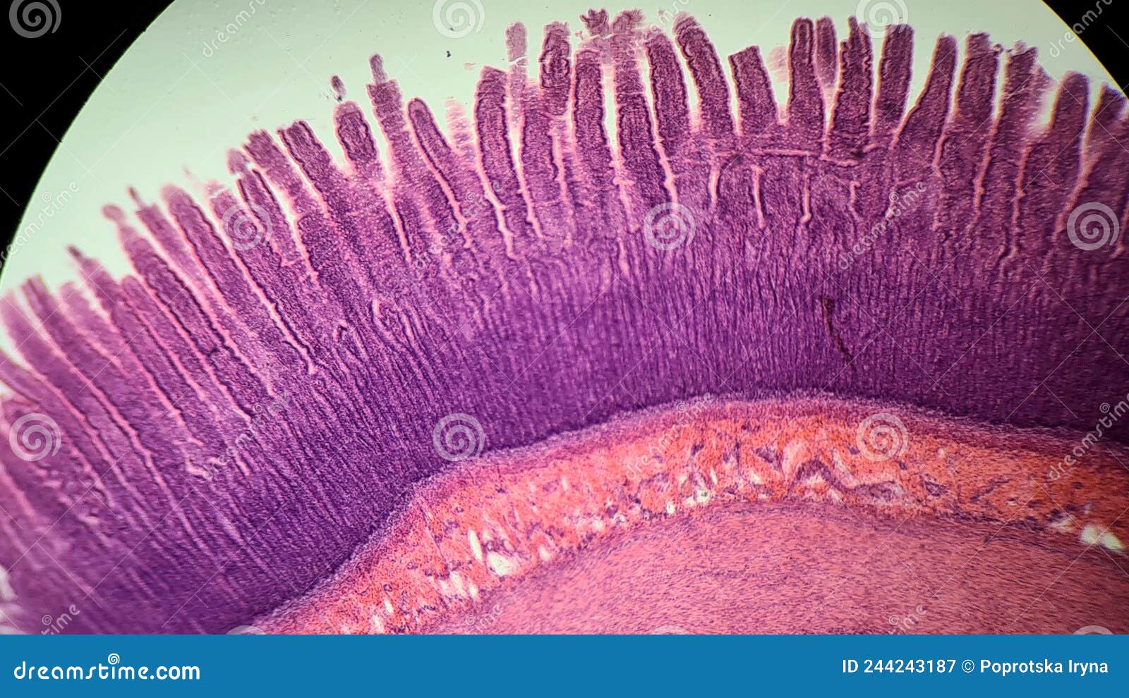 Permanent Preparation Of Intestinal Villi Under A Microscope Stock ...