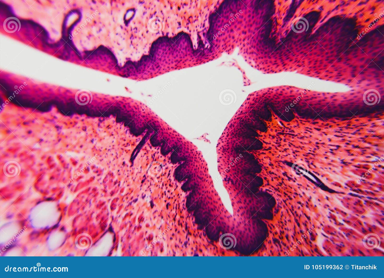 Perro Seccionado Transversalmente Del Esófago Foto de archivo - Imagen ...