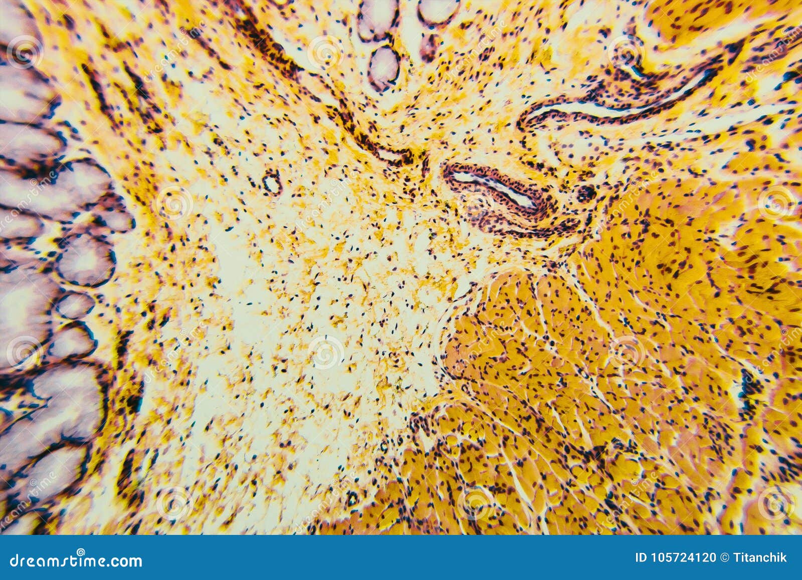 Perro Seccionado Transversalmente Del Esófago Foto de archivo - Imagen ...