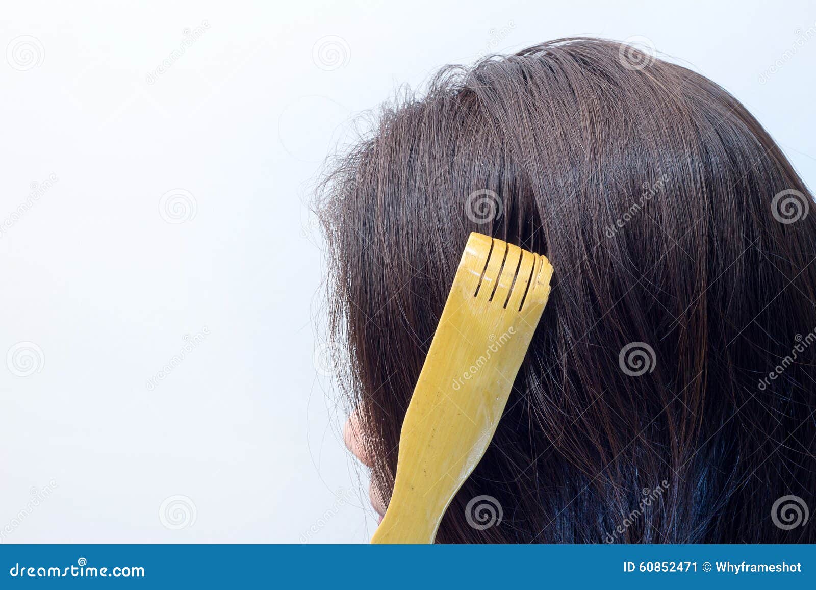 Persistent dandruff issue stock image. Image of medication - 60852471