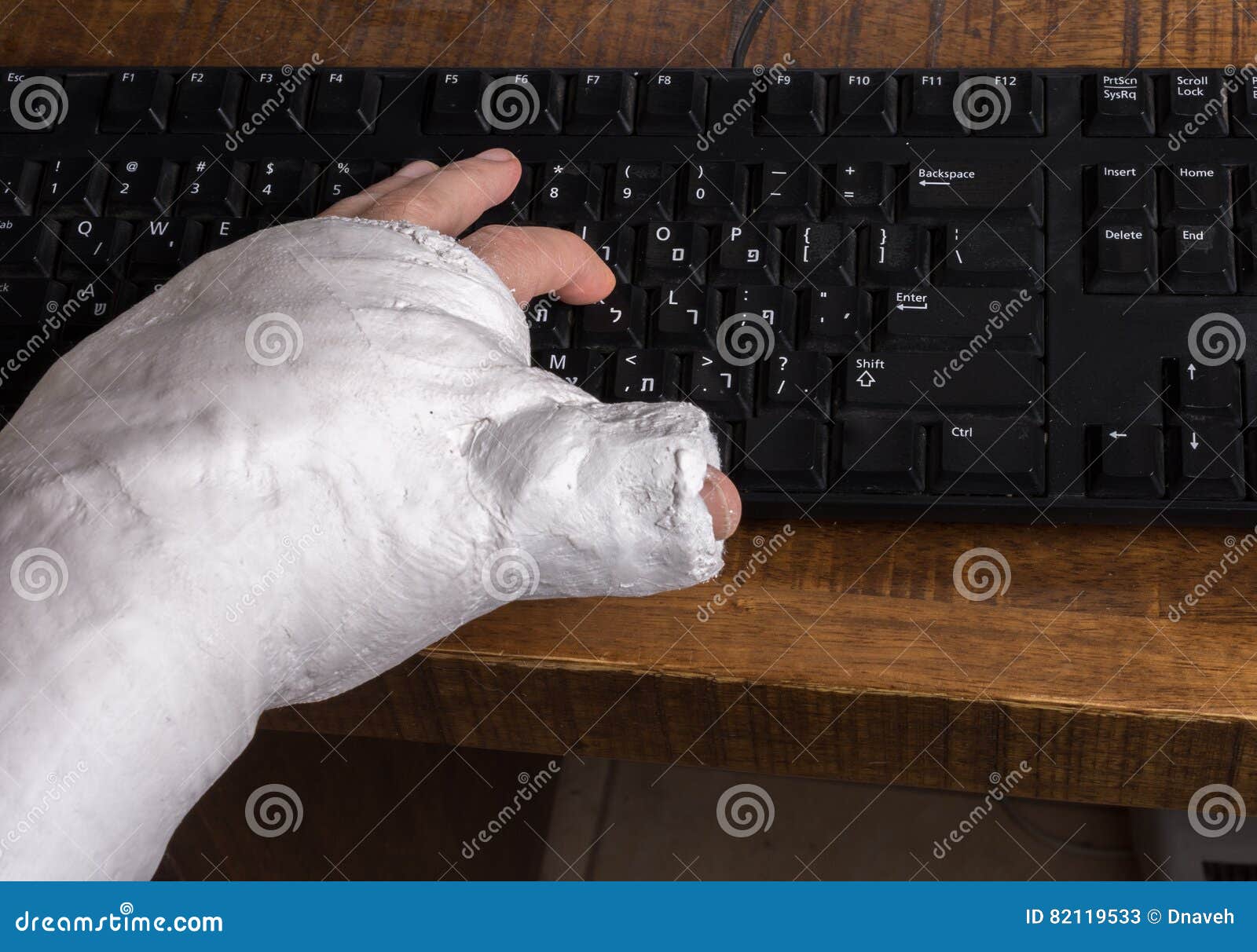 Person with Arm Cast Typing on a Keyboard Stock Image - Image of ...