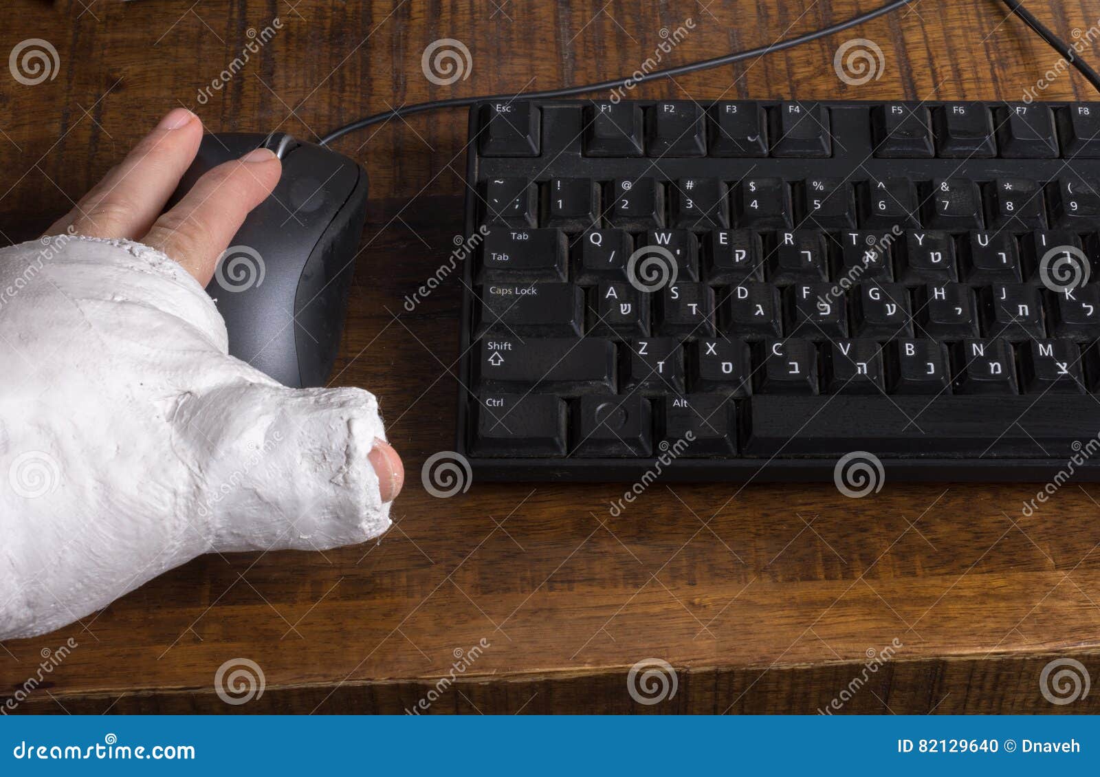 Person with Arm Cast Using a Computer Mouse Stock Photo - Image of pain ...