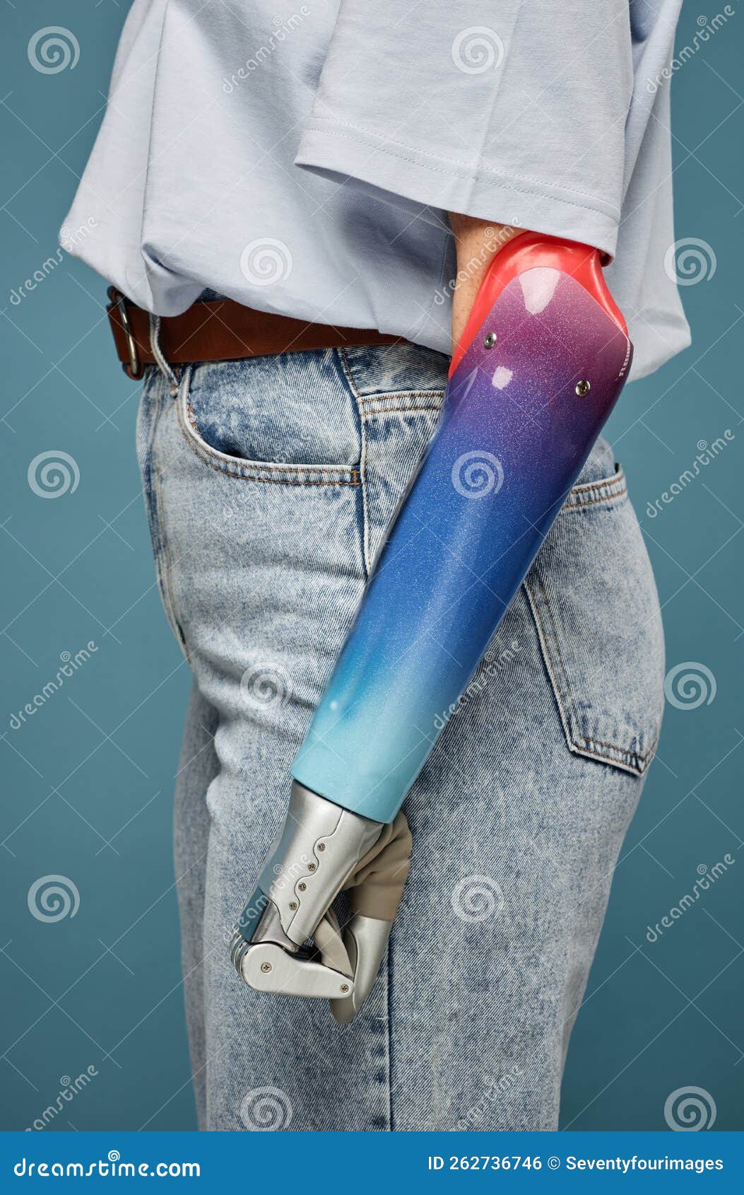 Person with Bionic Arm stock photo. Image of prosthetic - 262736746