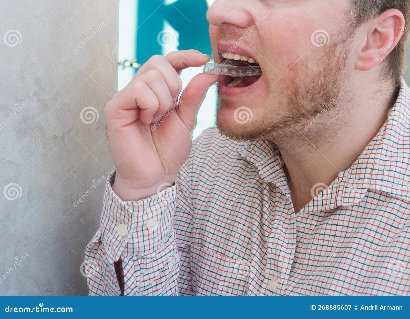 A Person Demonstrates Putting on a Plastic Aligner Plate from Brcusism ...