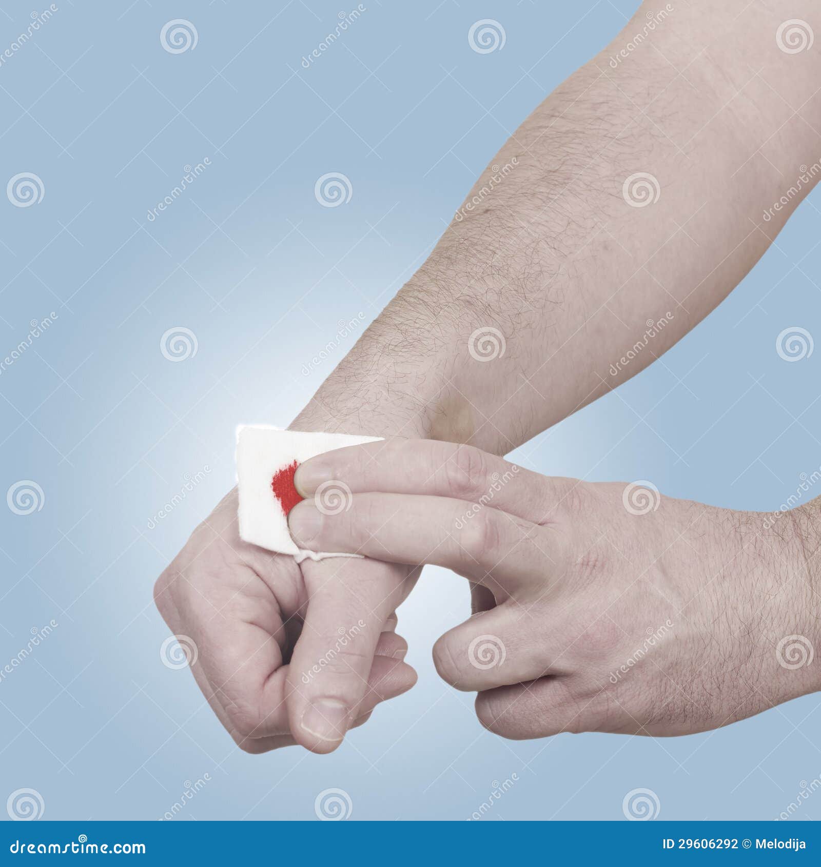 A Person Medically Dressed with a Cotton Ball and Bandage Over a Stock ...