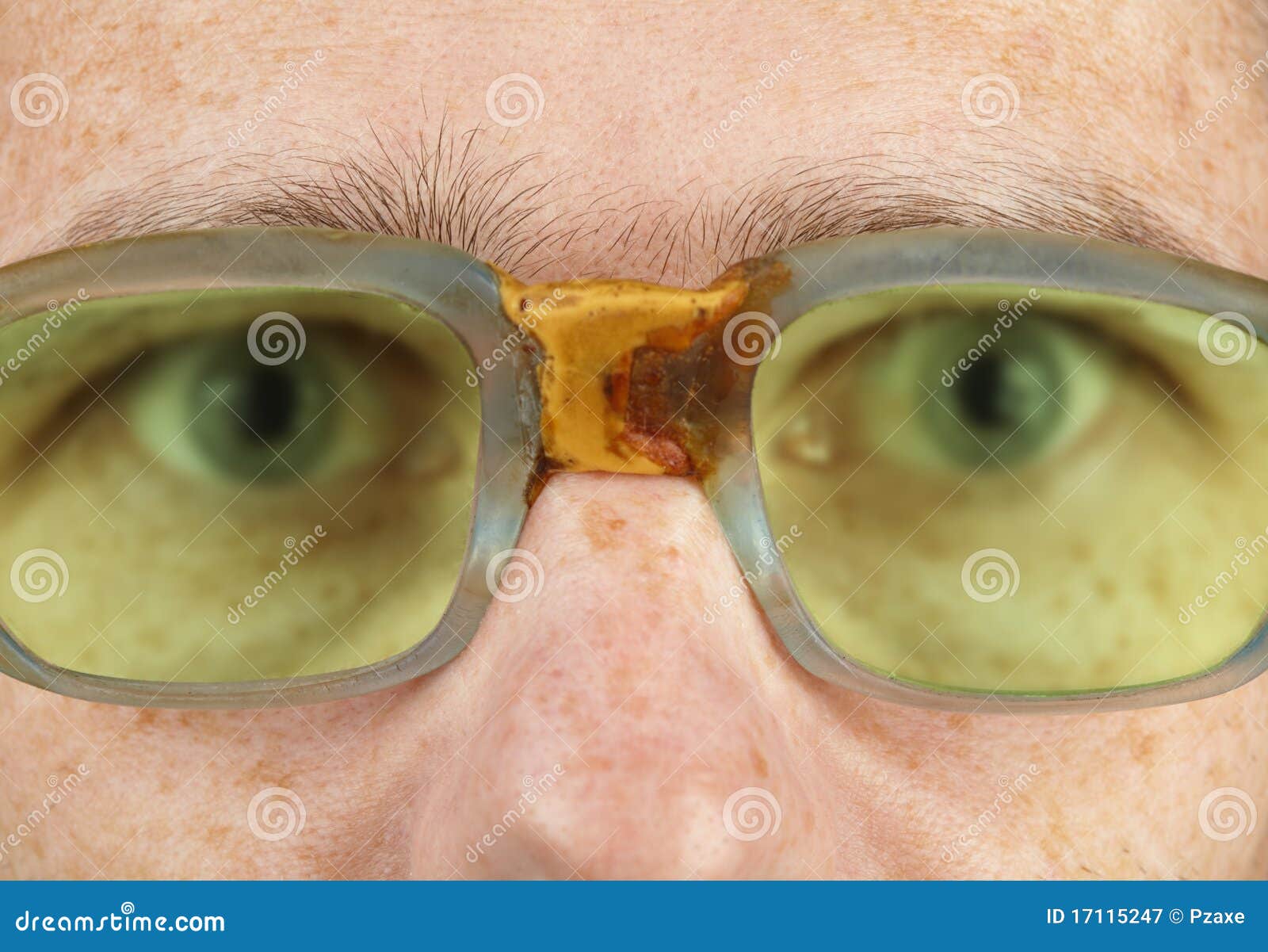 Person in Old Bad Spectacles with Poor Eyesight Stock Image - Image of ...