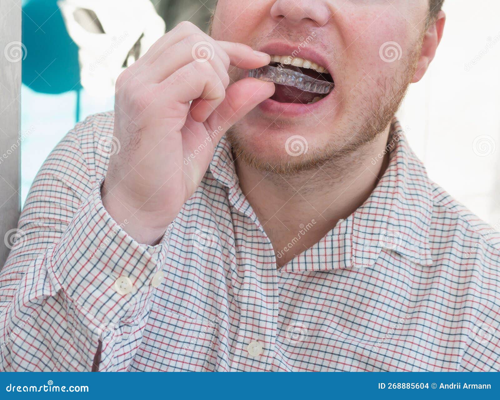 A Person Puts a Plastic Aligner Plate on His Teeth from Brcusism, a Cap ...